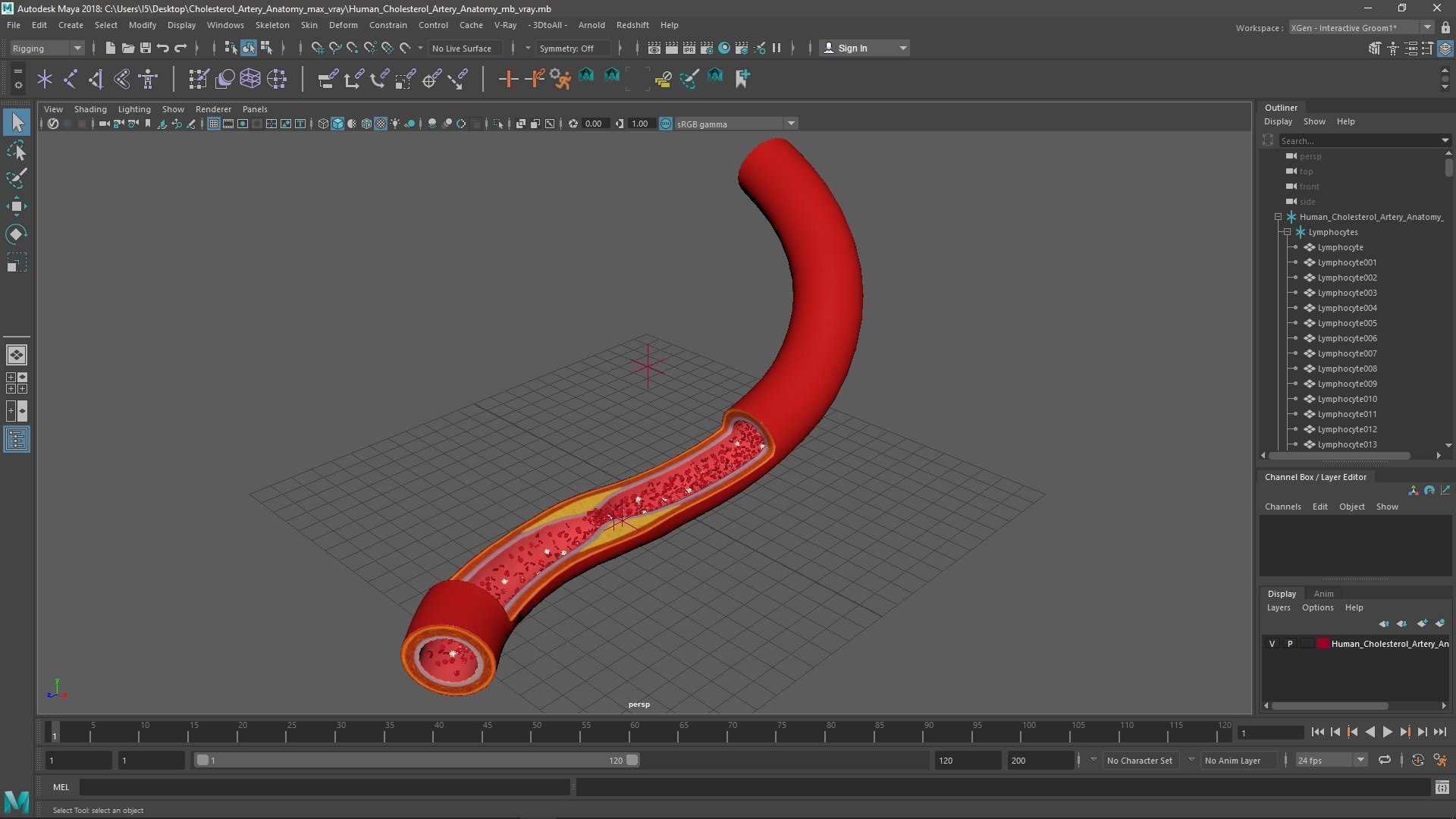 Human Cholesterol Artery Anatomy Model - TurboSquid 2330259