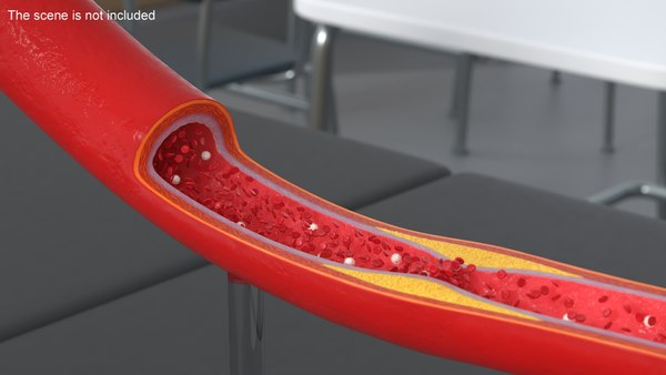 modelo 3d Anatomía de la arteria del colesterol humano - TurboSquid 2330259