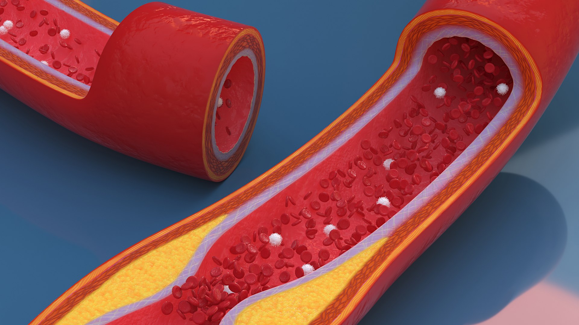 Human Cholesterol Artery Anatomy Model - TurboSquid 2330259