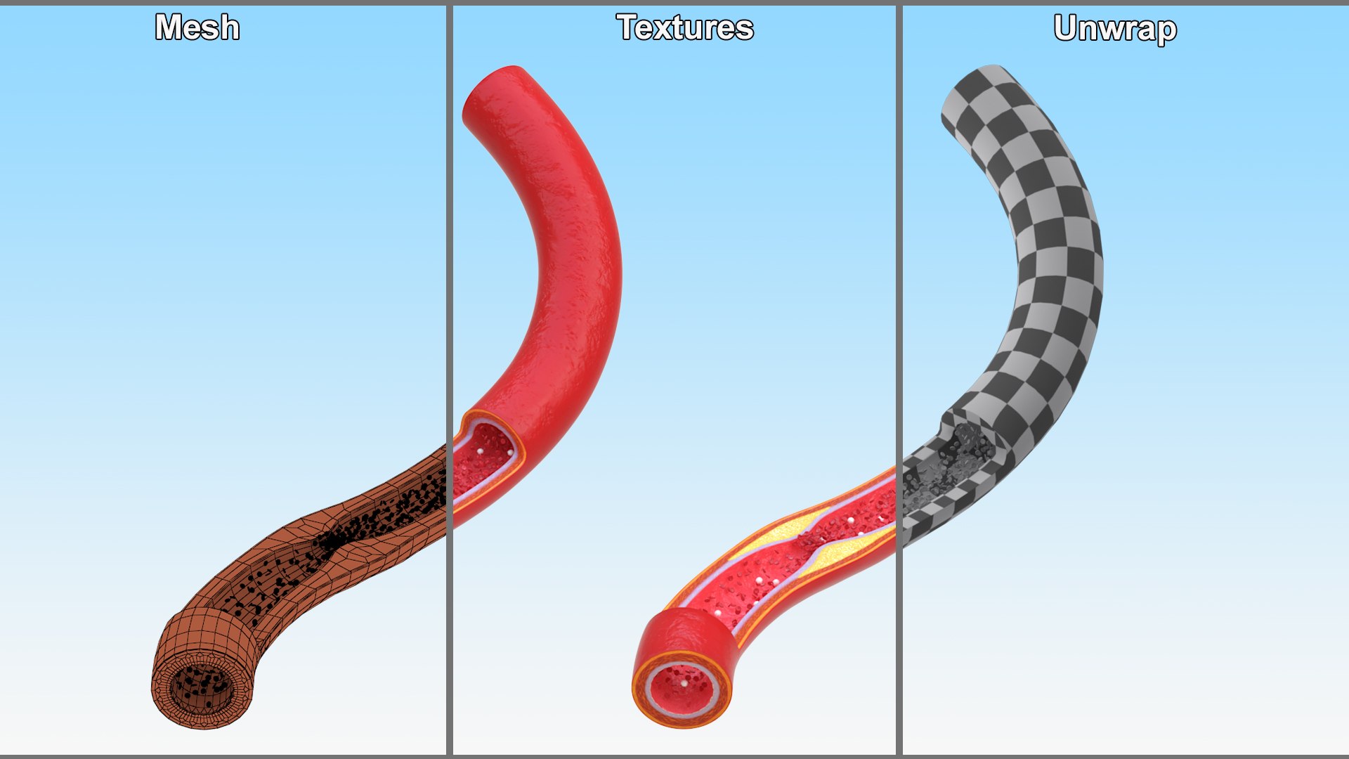 Human Cholesterol Artery Anatomy Model - TurboSquid 2330259