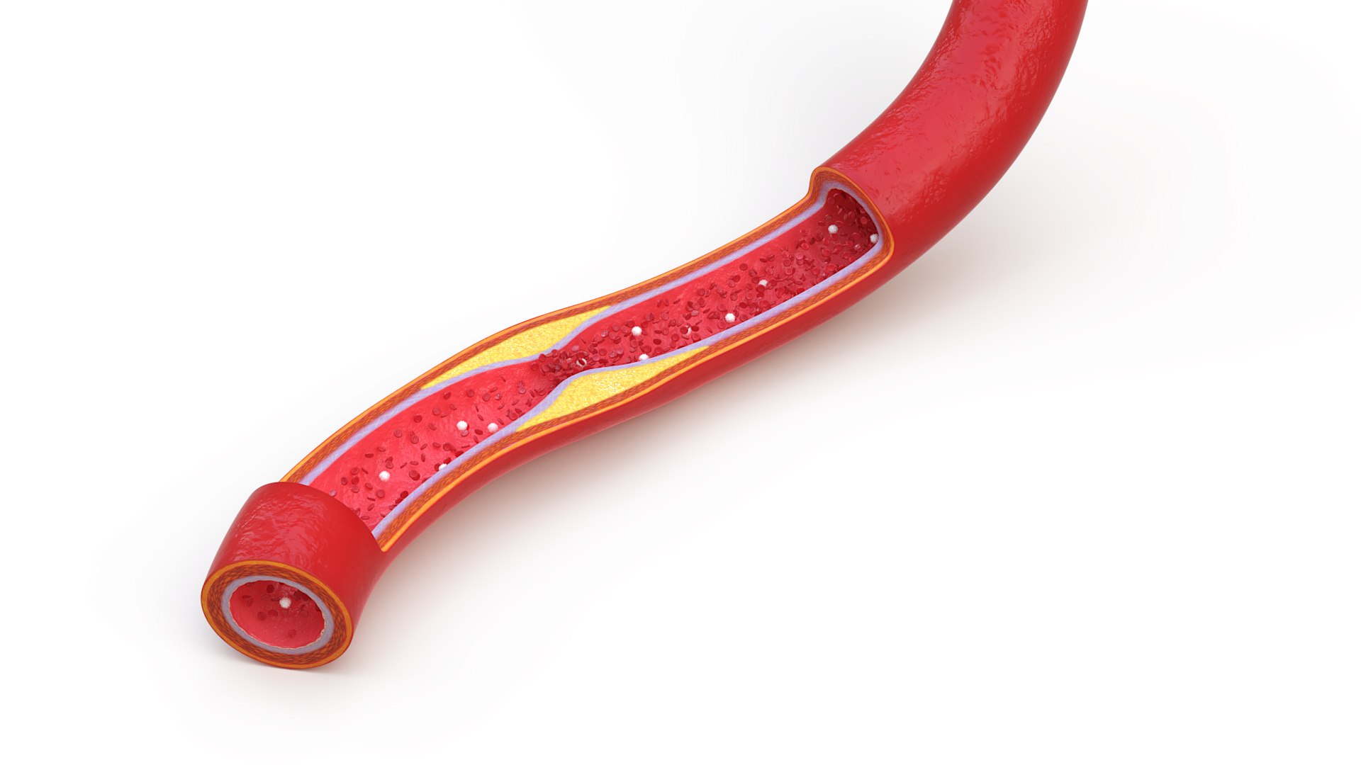 Human Cholesterol Artery Anatomy Model - TurboSquid 2330259