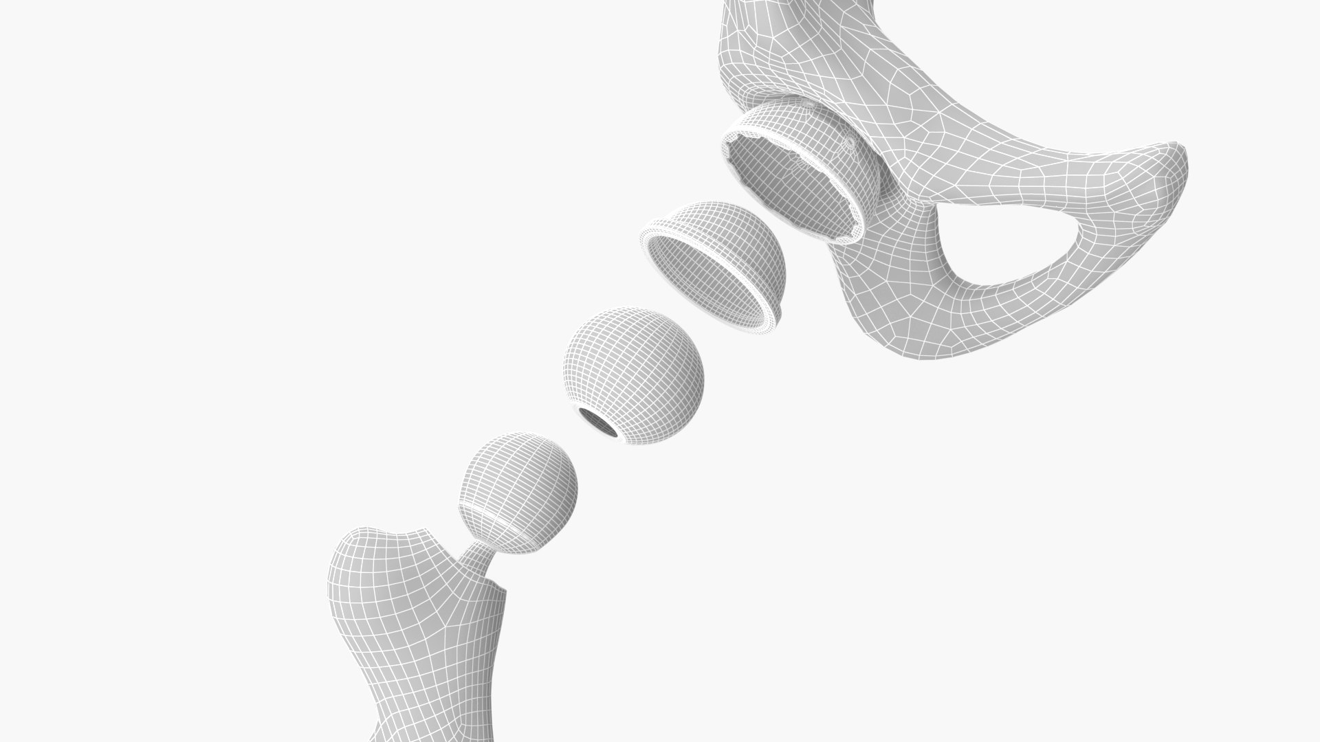 Hip Bone Replacement Surgery V02 3D Model - TurboSquid 1744809