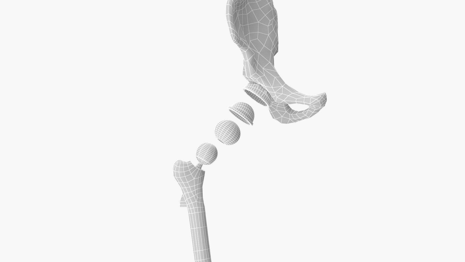 Hip Bone Replacement Surgery V02 3D Model - TurboSquid 1744809