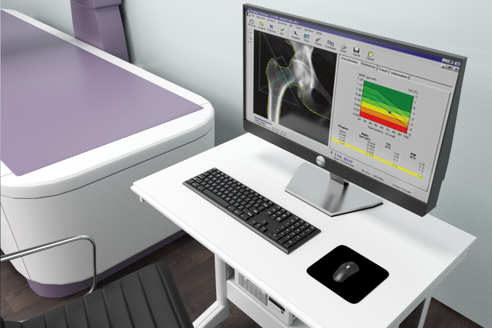 Bone Density Scanner 3D Model - TurboSquid 1344978