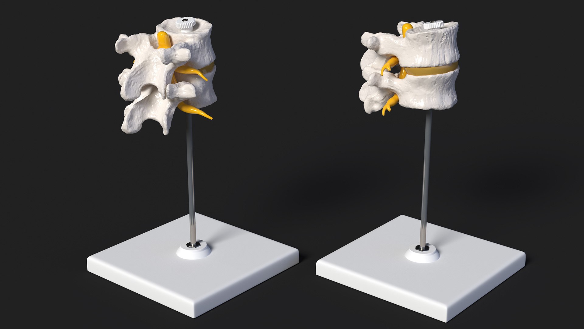 3D Stand With Herniated Spinal Vertebrae Model - TurboSquid 2051054