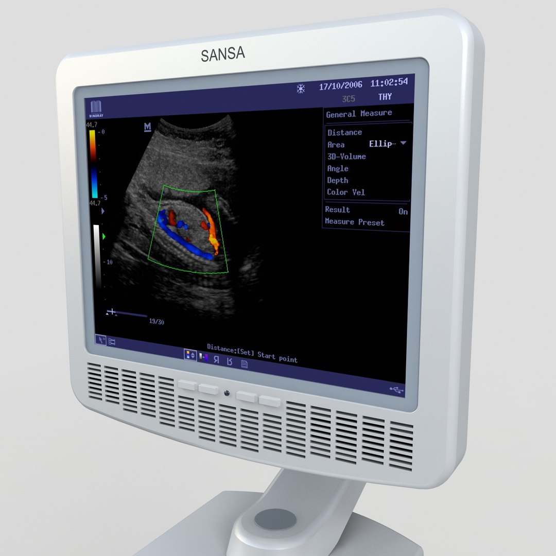 3d Ultrasound Machine Model