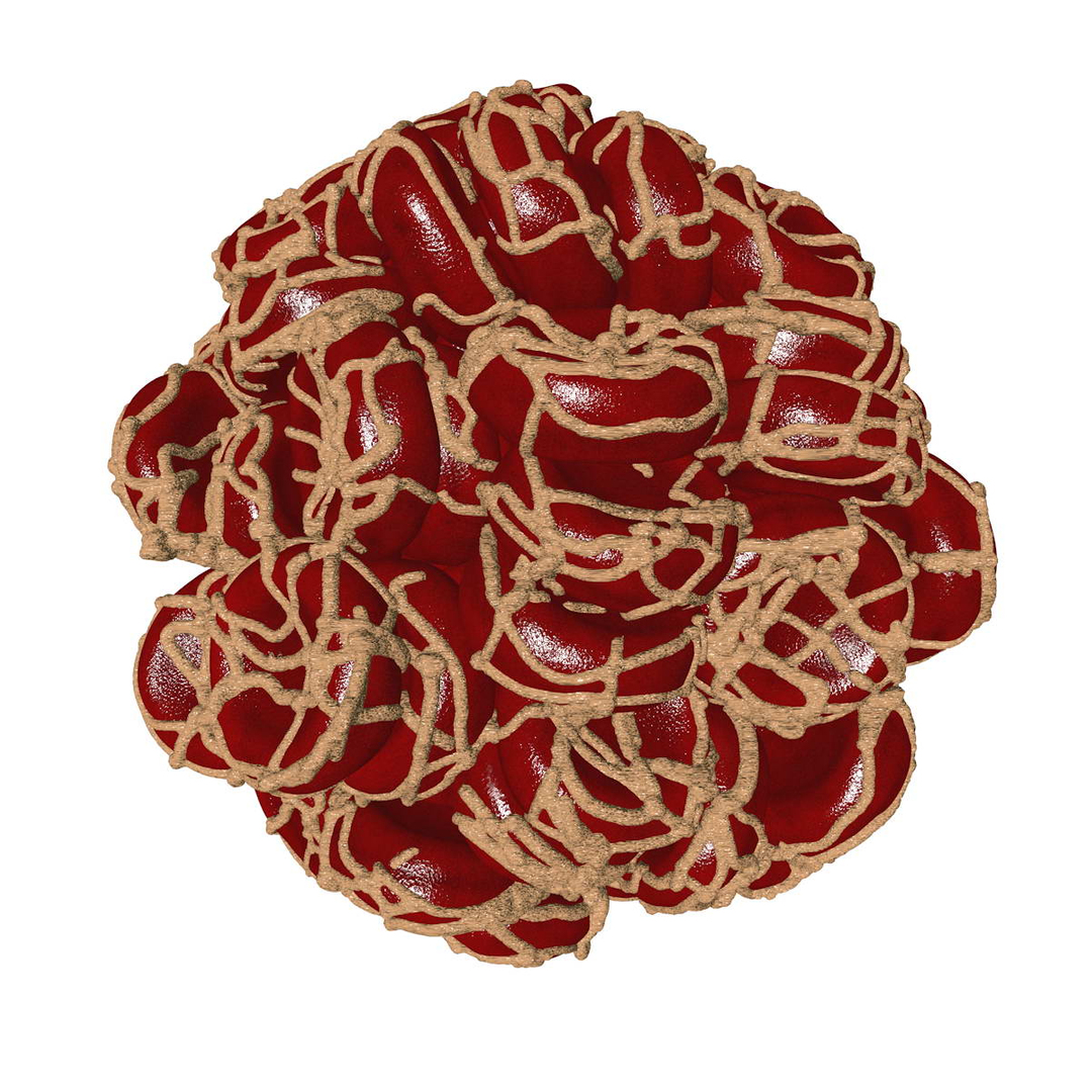 Clotted Blood Cells 3d Model
