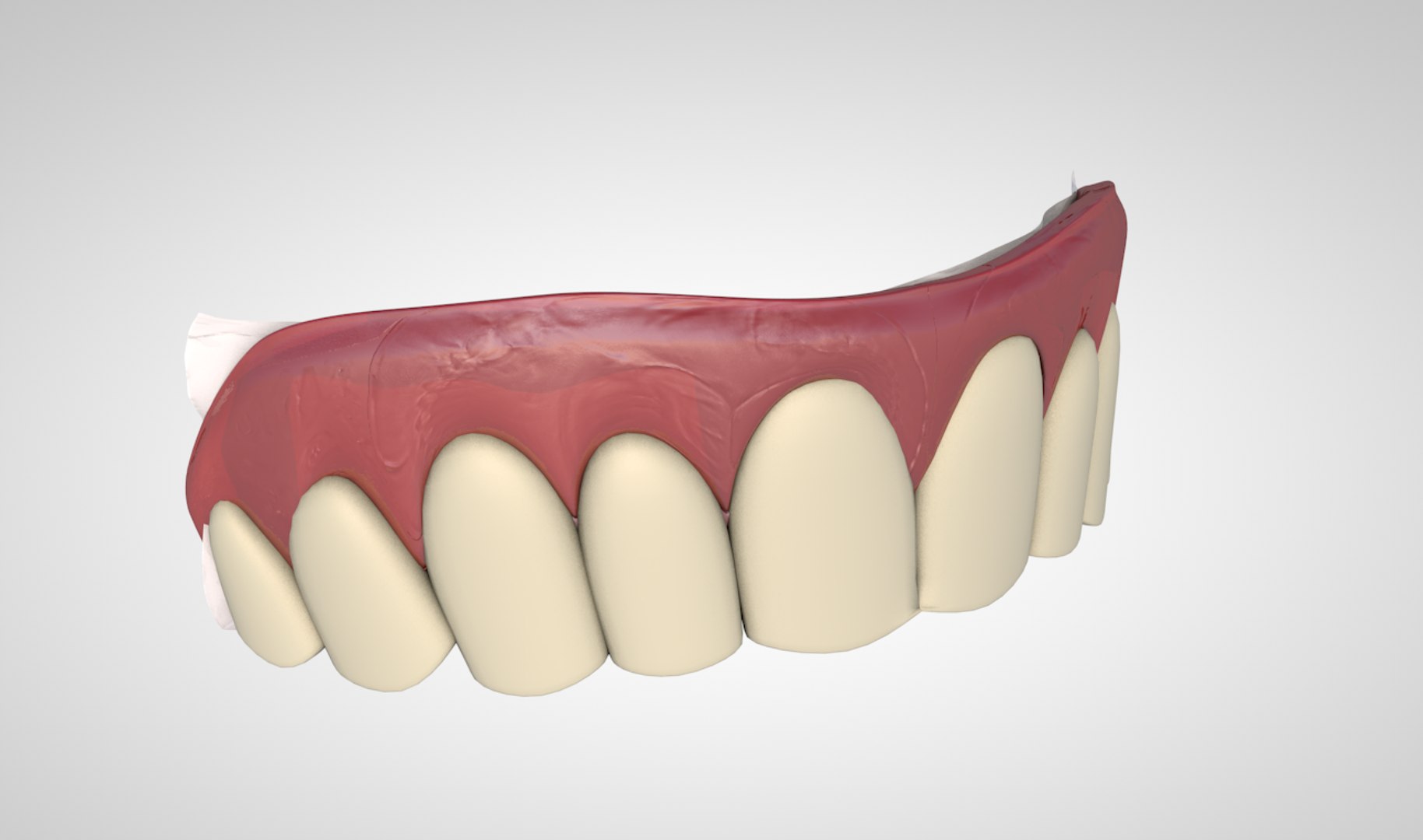 3D Model Crown Veneer Teeth - TurboSquid 1441918