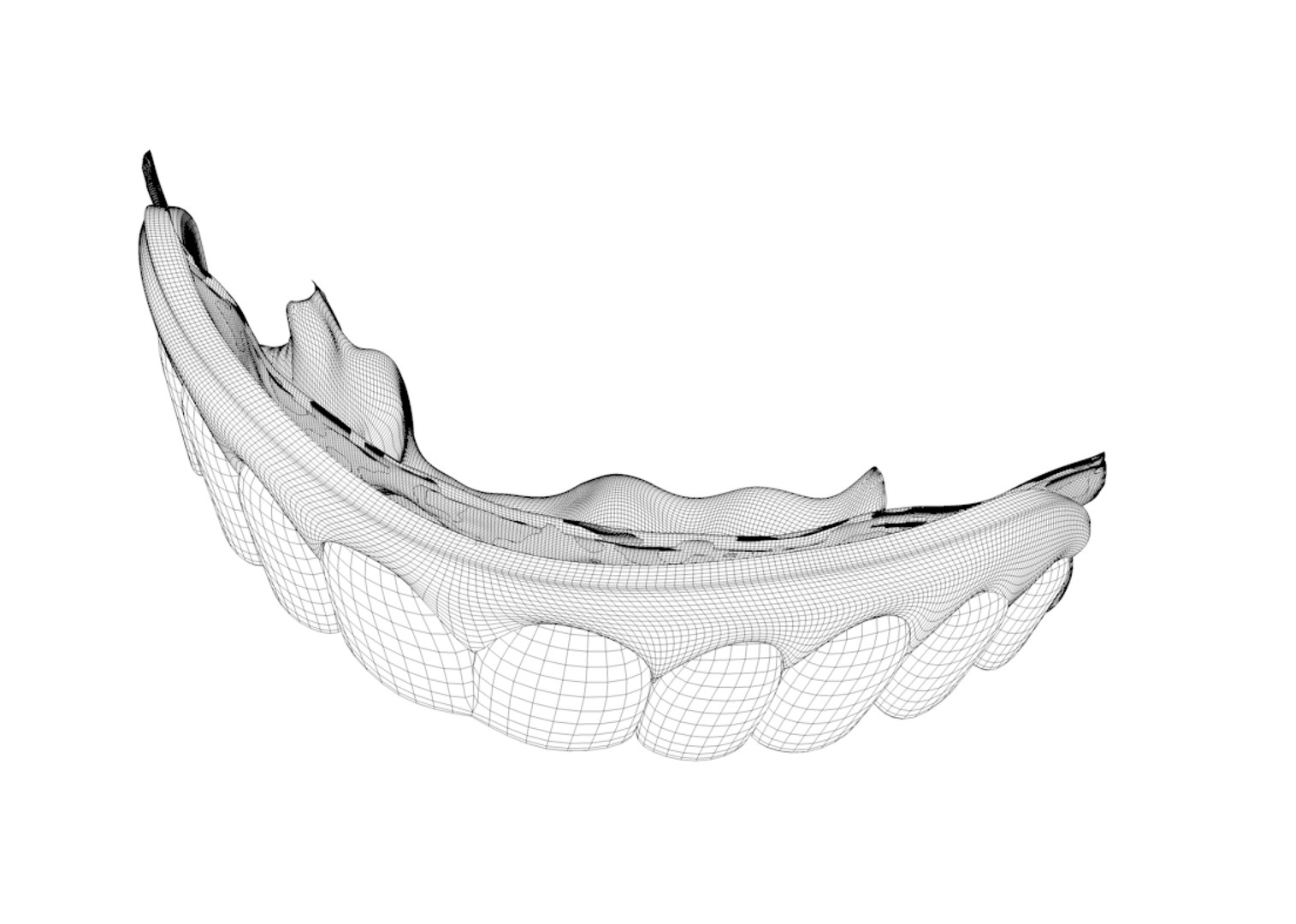 3D Model Crown Veneer Teeth - TurboSquid 1441918