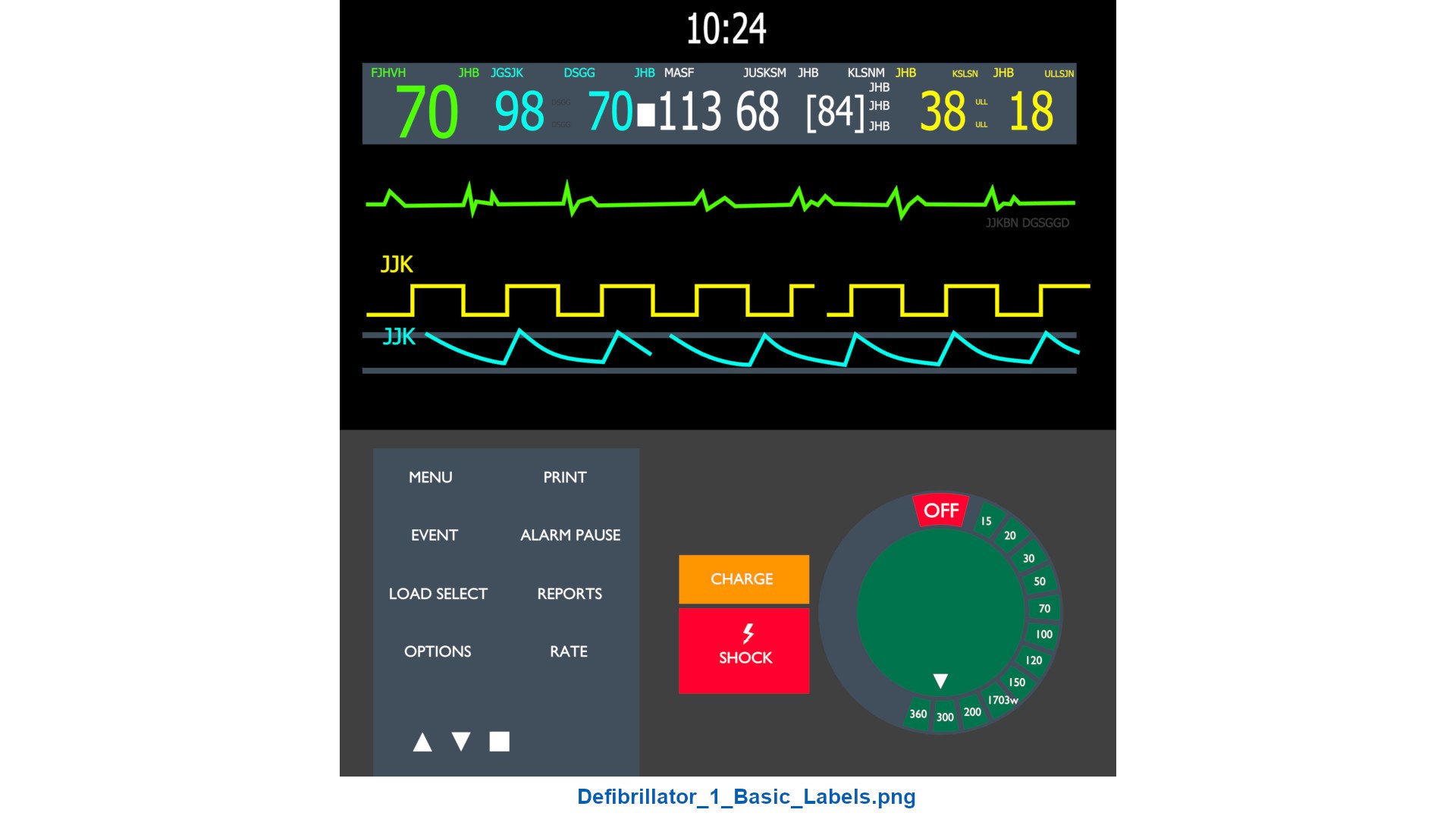 3D Model Defibrillator 1 Basic - TurboSquid 2039568