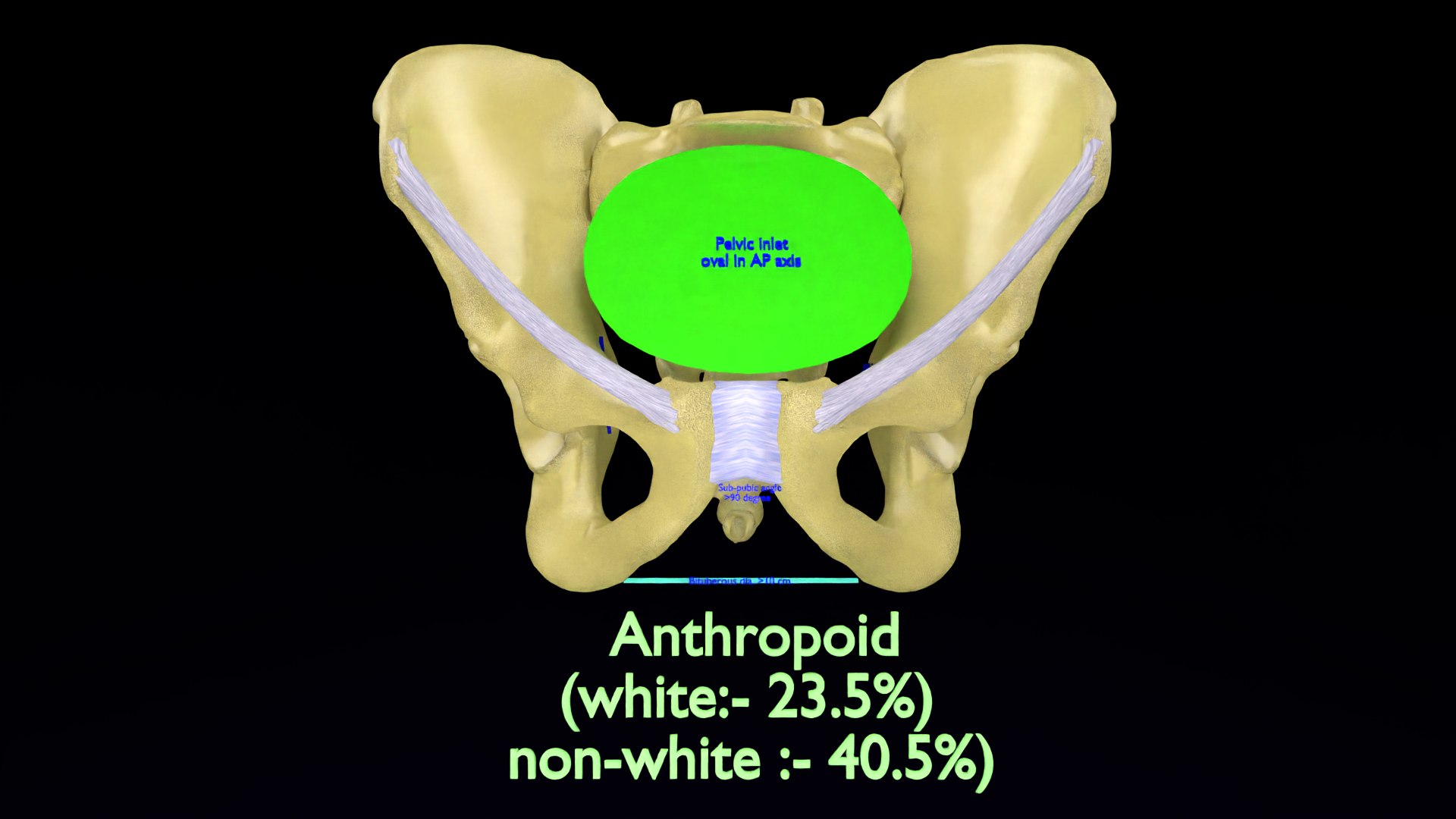 3D Pelvis Types Hip Bone Labelled Detailed - TurboSquid 2044764