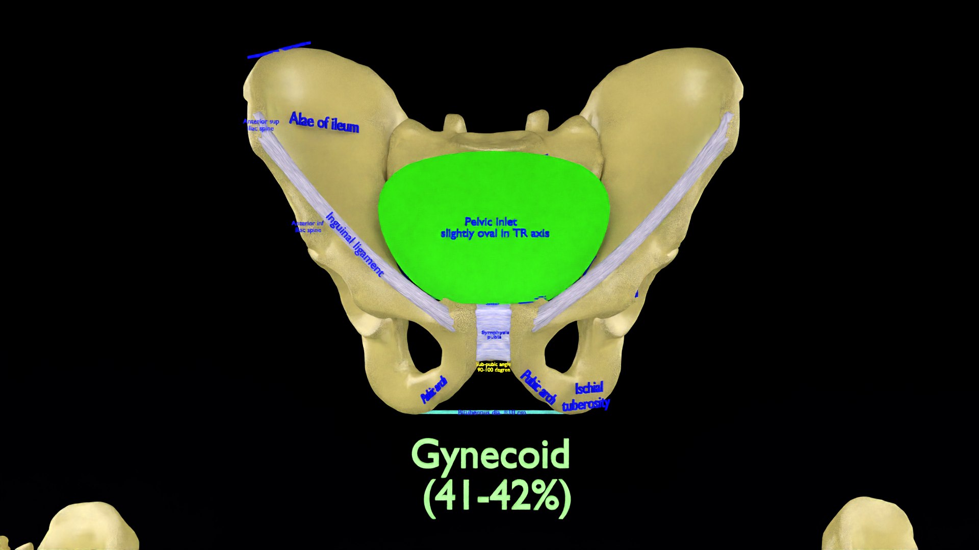 3D Pelvis Types Hip Bone Labelled Detailed - TurboSquid 2044764