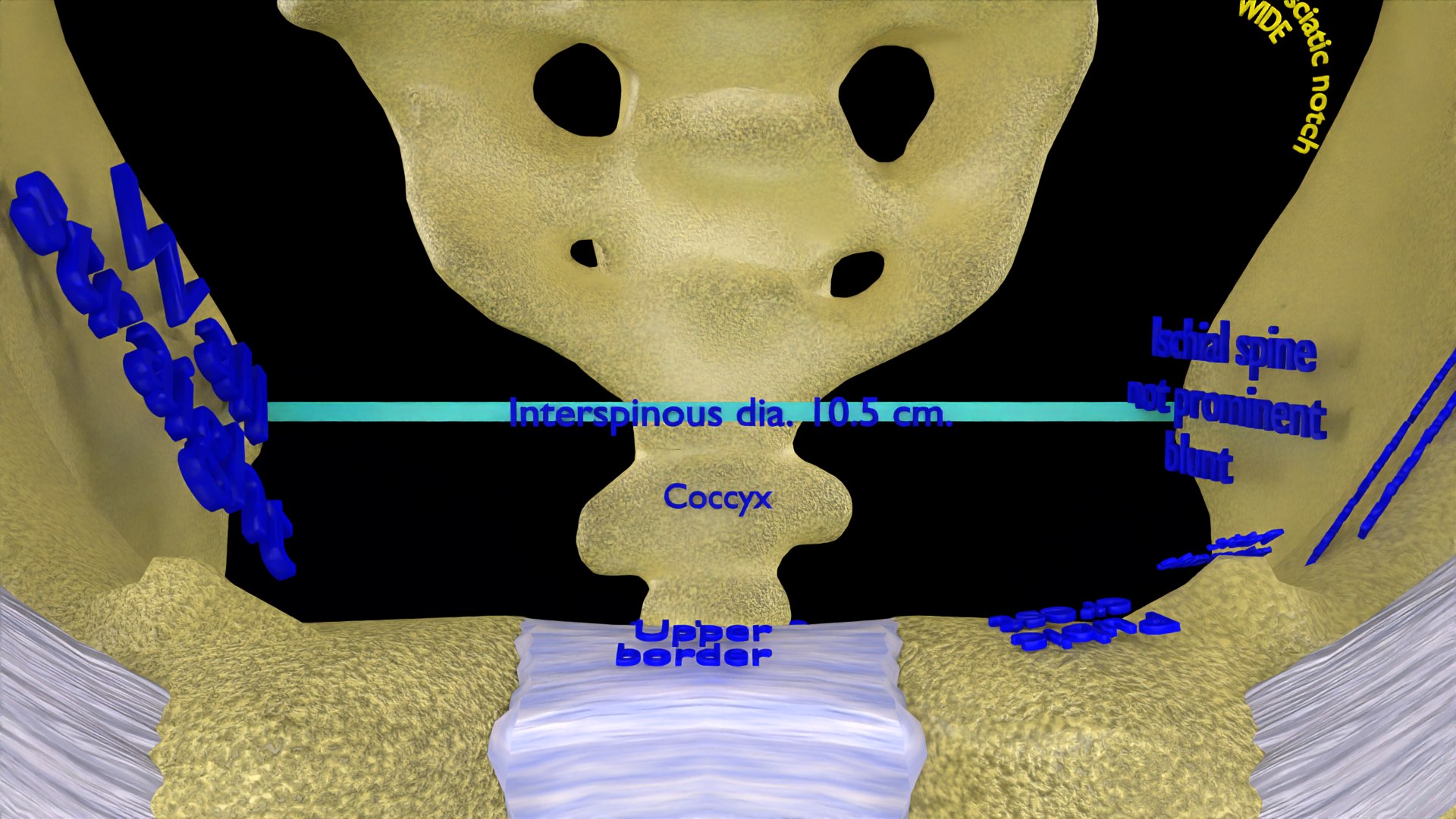 3D Pelvis Types Hip Bone Labelled Detailed - TurboSquid 2044764