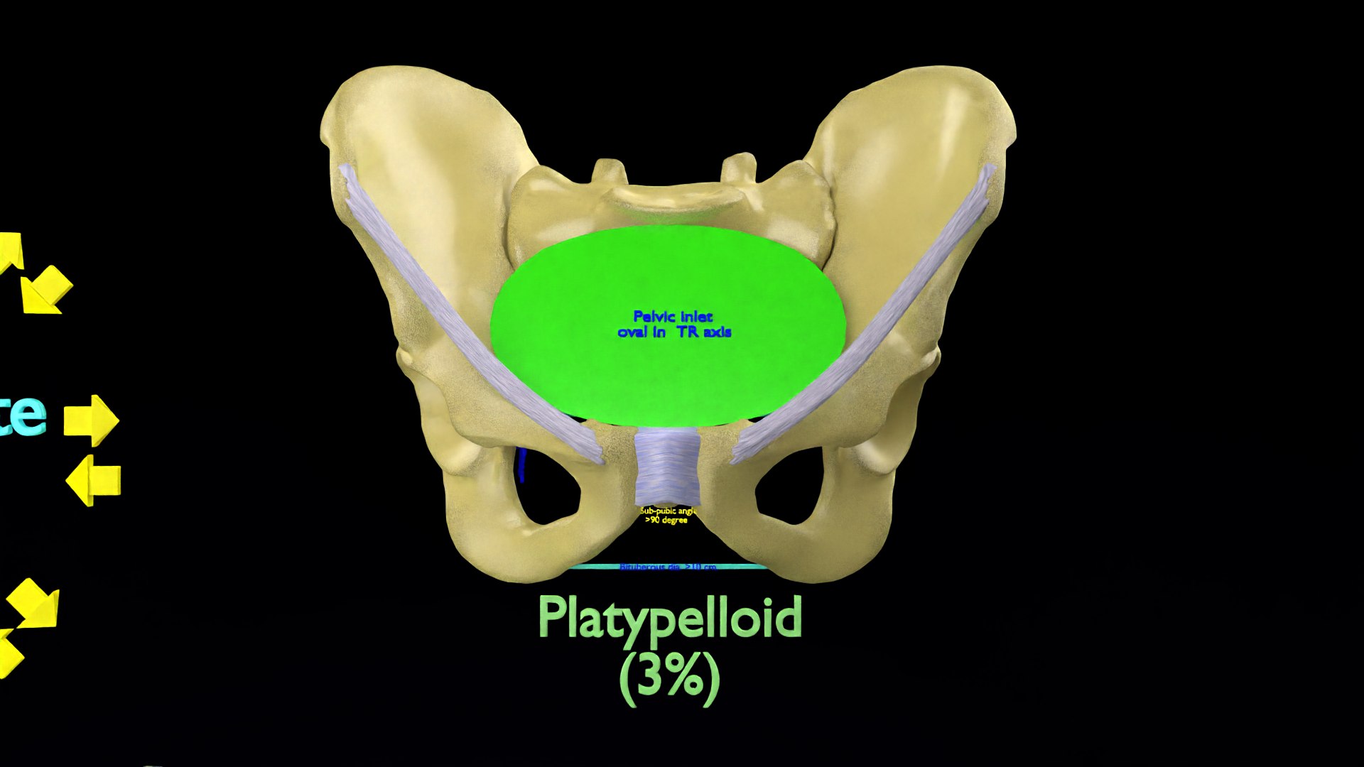 3D Pelvis Types Hip Bone Labelled Detailed - TurboSquid 2044764