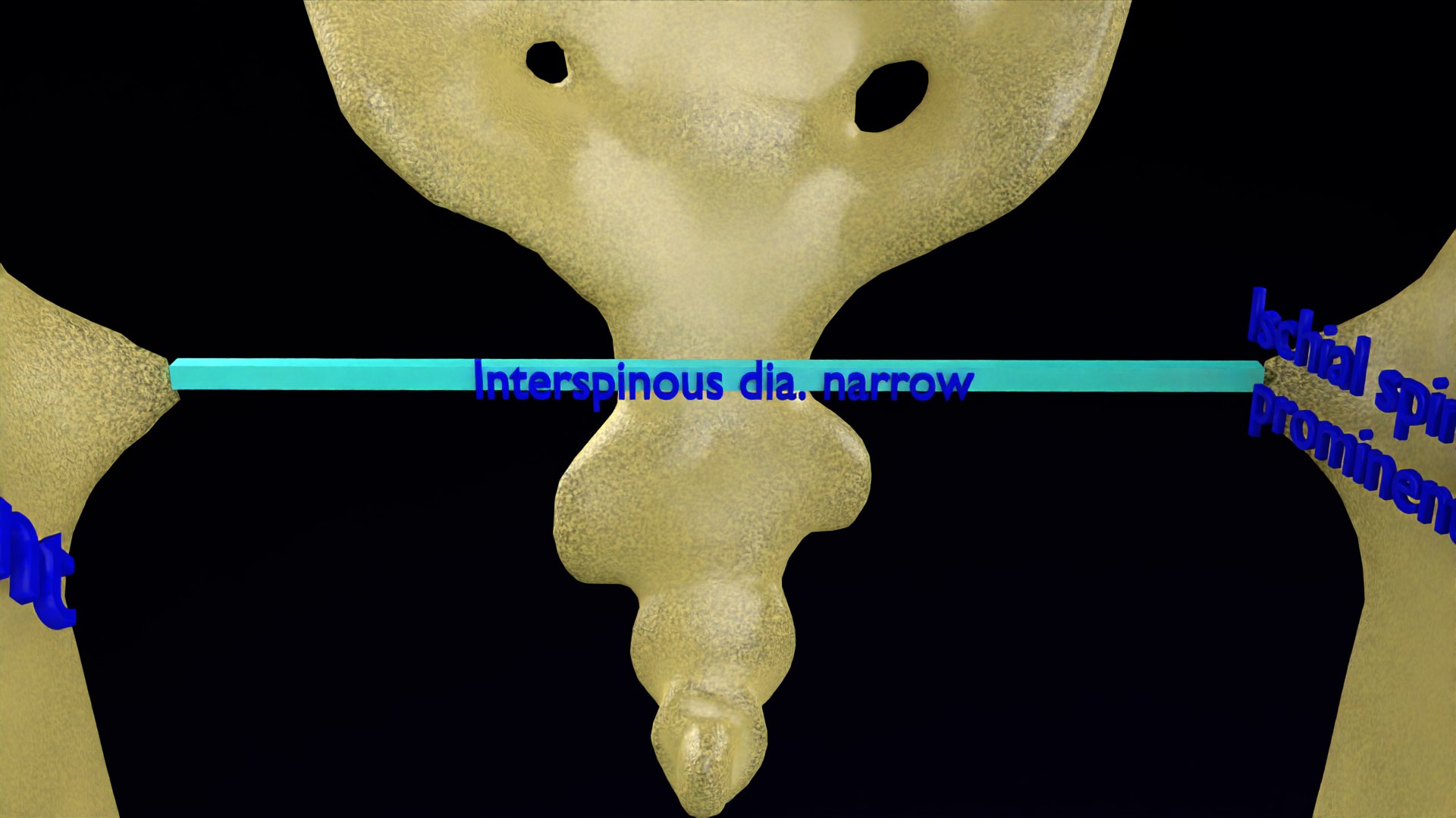 3D Pelvis Types Hip Bone Labelled Detailed - TurboSquid 2044764