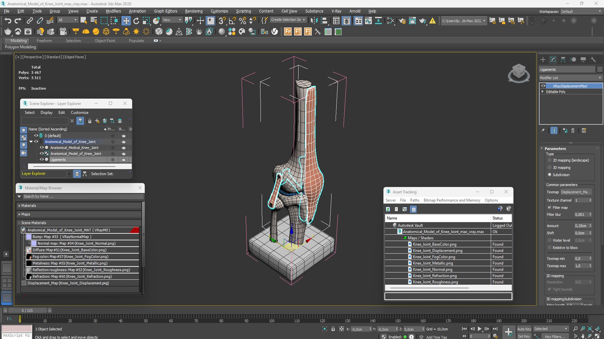3D Anatomical Model Of Knee Joint Model - TurboSquid 2279778