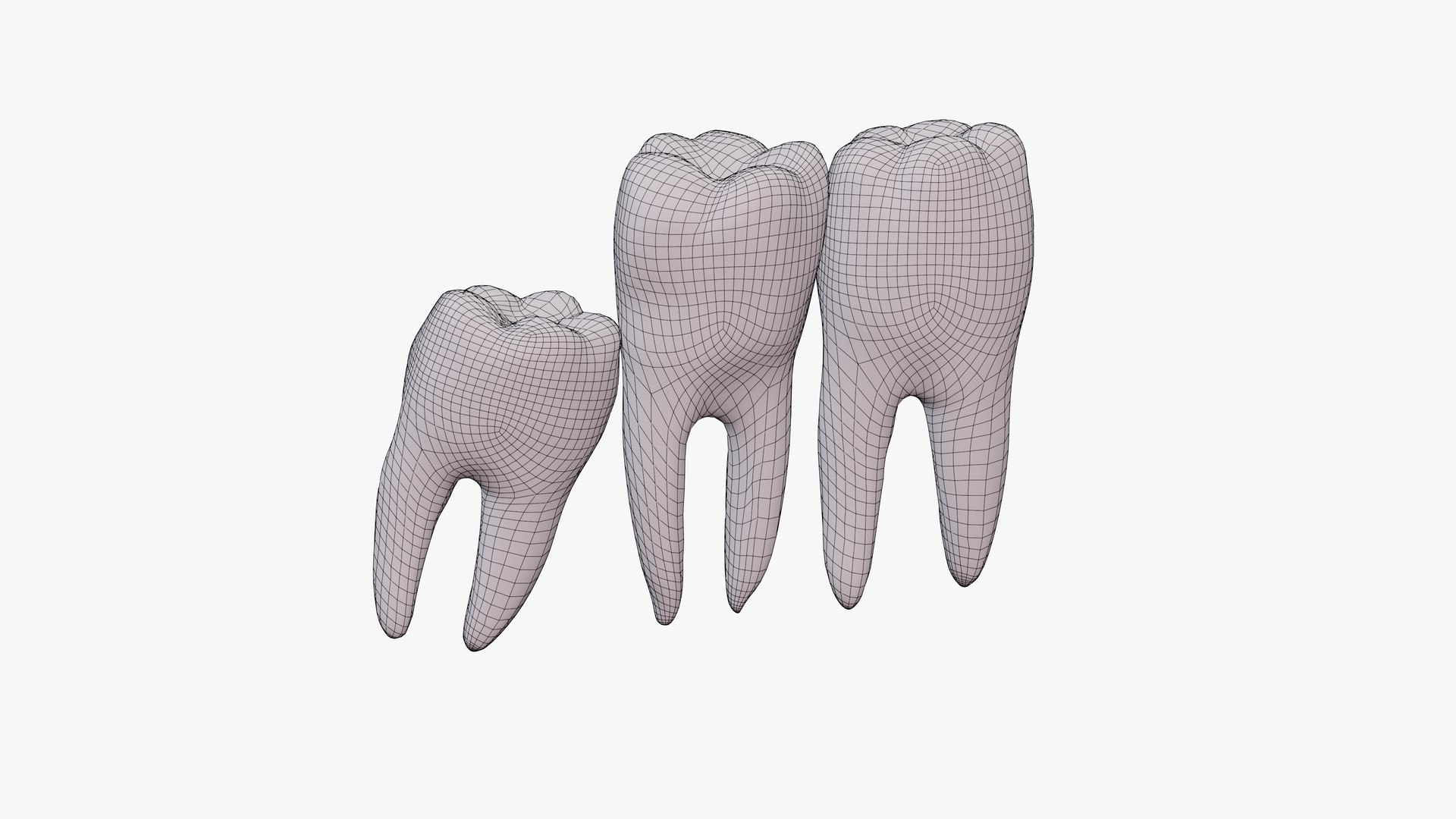 3D Model Impacted Wisdom Teeth - TurboSquid 1866134