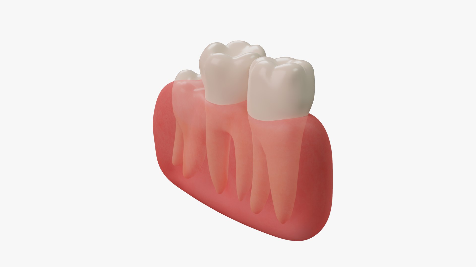 3D Model Impacted Wisdom Teeth - TurboSquid 1866134