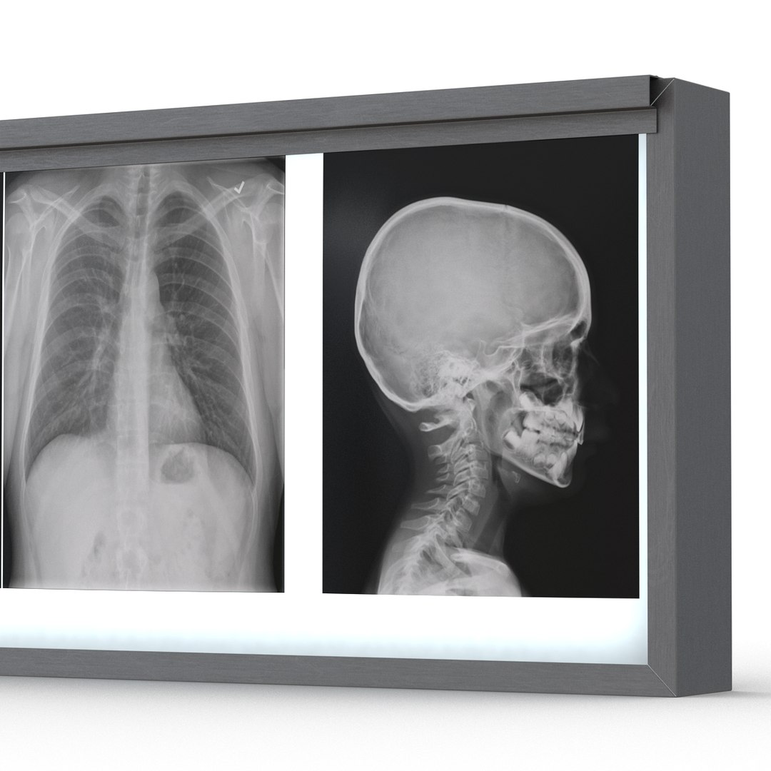 3d model xray light box x