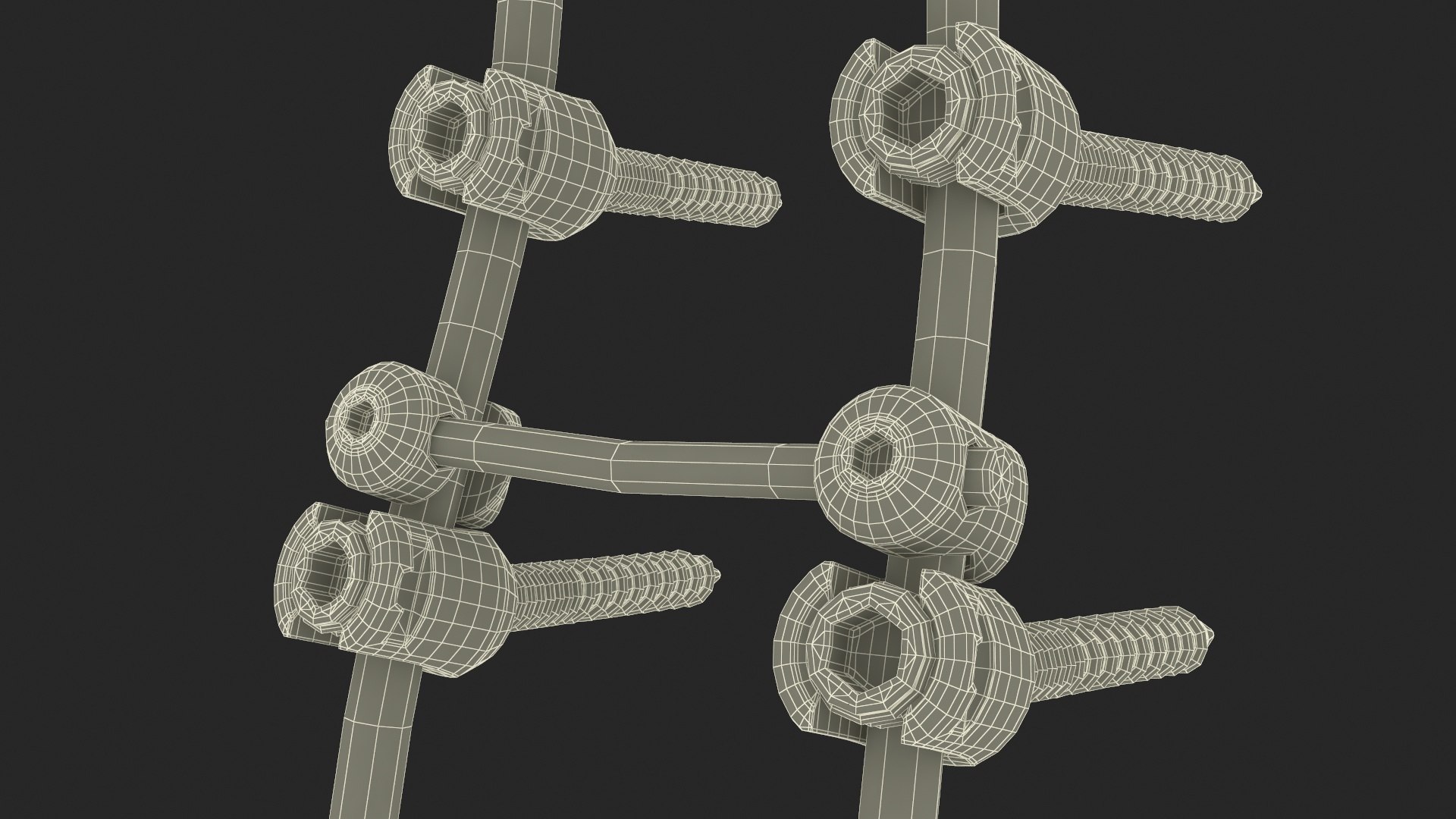 3D Lumbar Cervical Spine Fixation System - TurboSquid 2205813