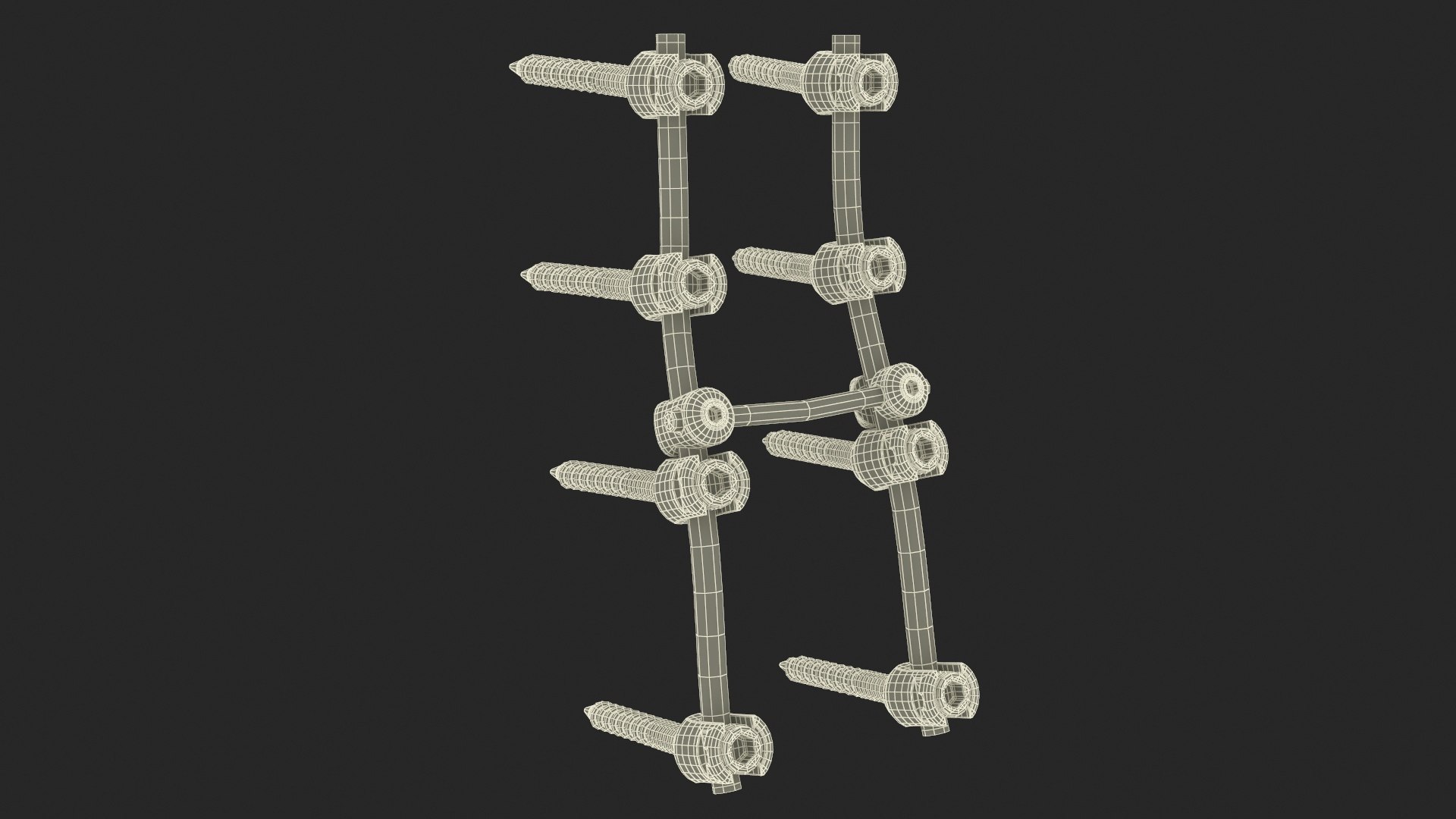 3D Lumbar Cervical Spine Fixation System - TurboSquid 2205813