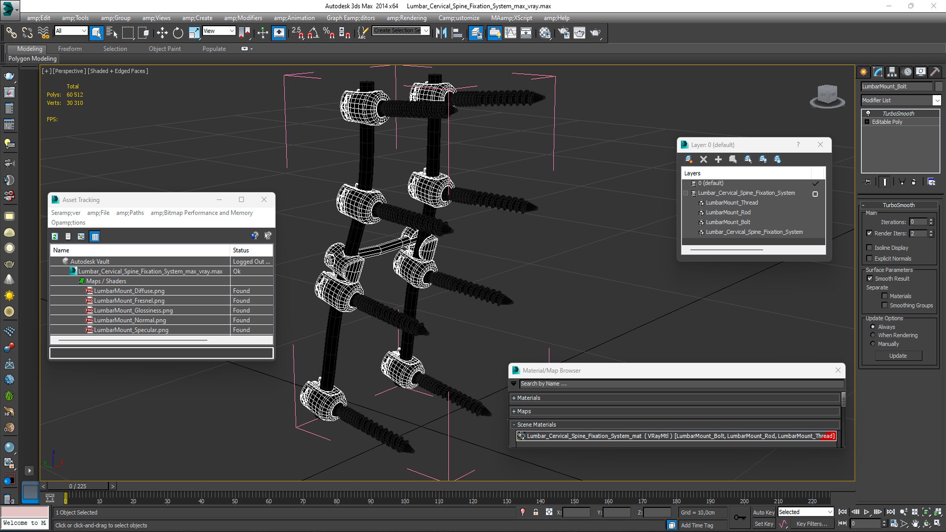 3D Lumbar Cervical Spine Fixation System - TurboSquid 2205813