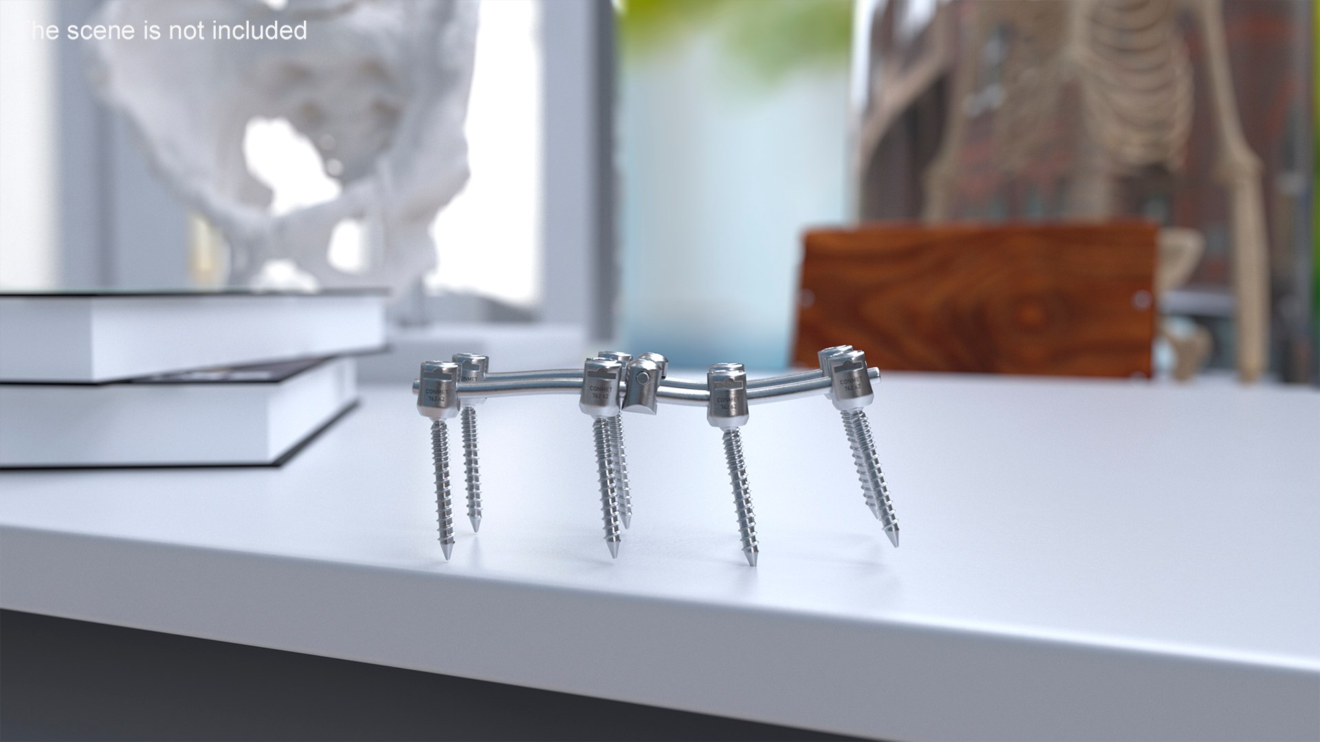 3D Lumbar Cervical Spine Fixation System - TurboSquid 2205813