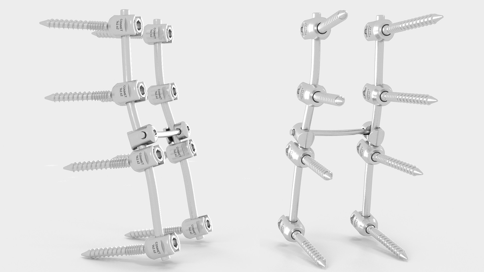 3D Lumbar Cervical Spine Fixation System - TurboSquid 2205813