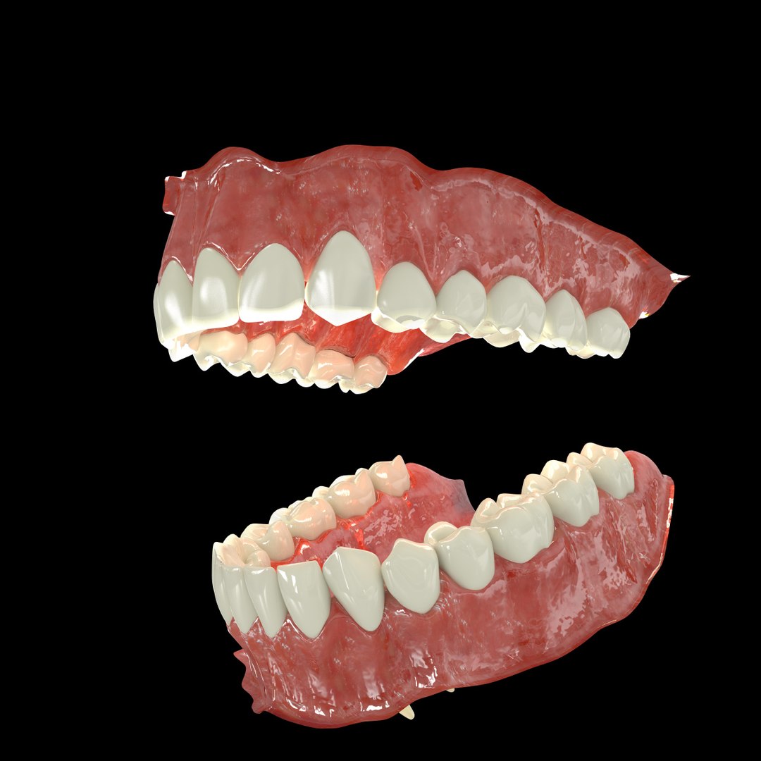 3d Human Teeth Model