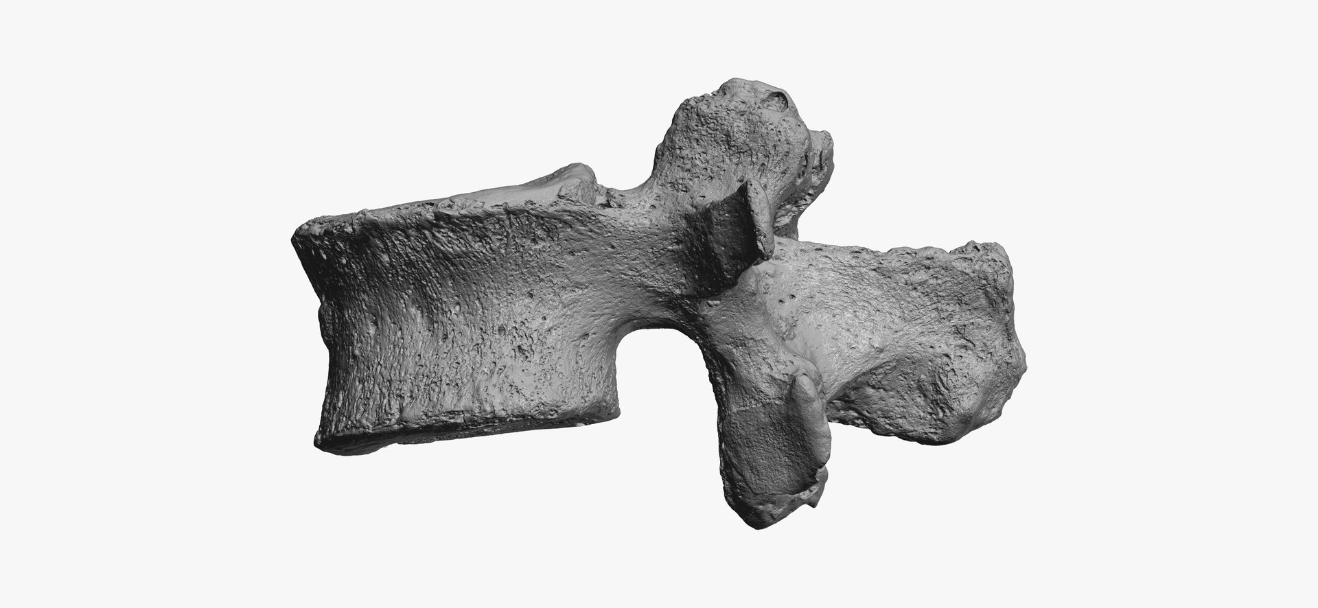 3D Model Lumbar Vertebrae L1 L5 - TurboSquid 1538396