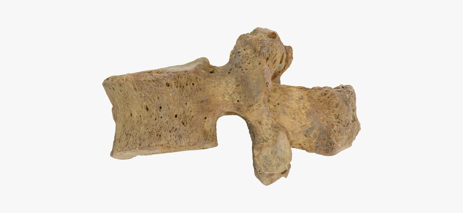 3D Model Lumbar Vertebrae L1 L5 - TurboSquid 1538396