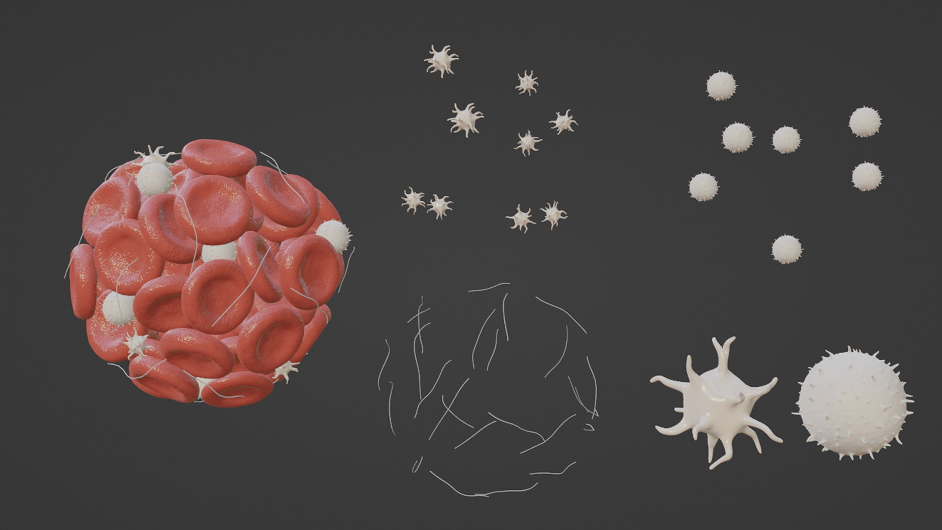 Blood Clot Thrombus 3D model - TurboSquid 2035235