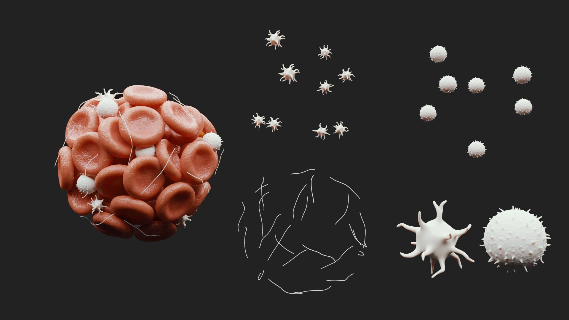 Blood Clot Thrombus 3D model - TurboSquid 2035235