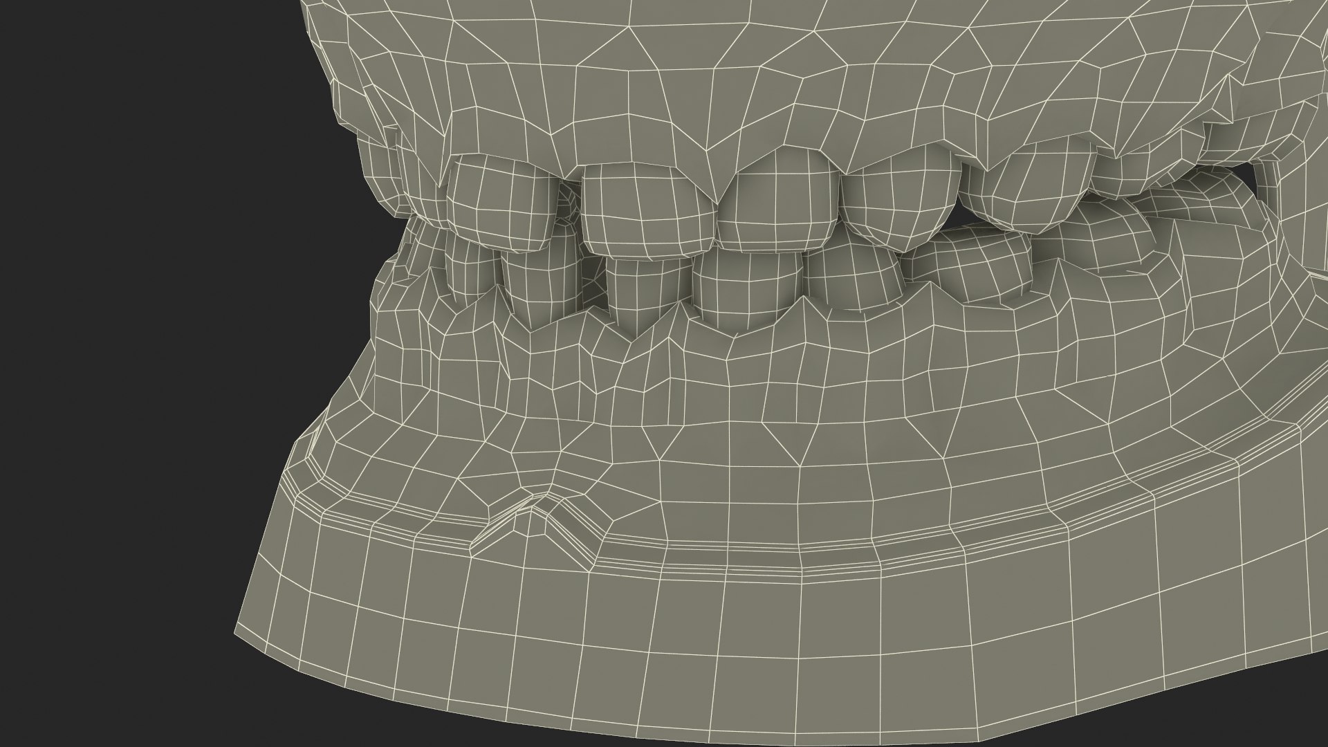 Pediatric Typodont Demonstration Model with Removable Gapped Teeth 3D ...
