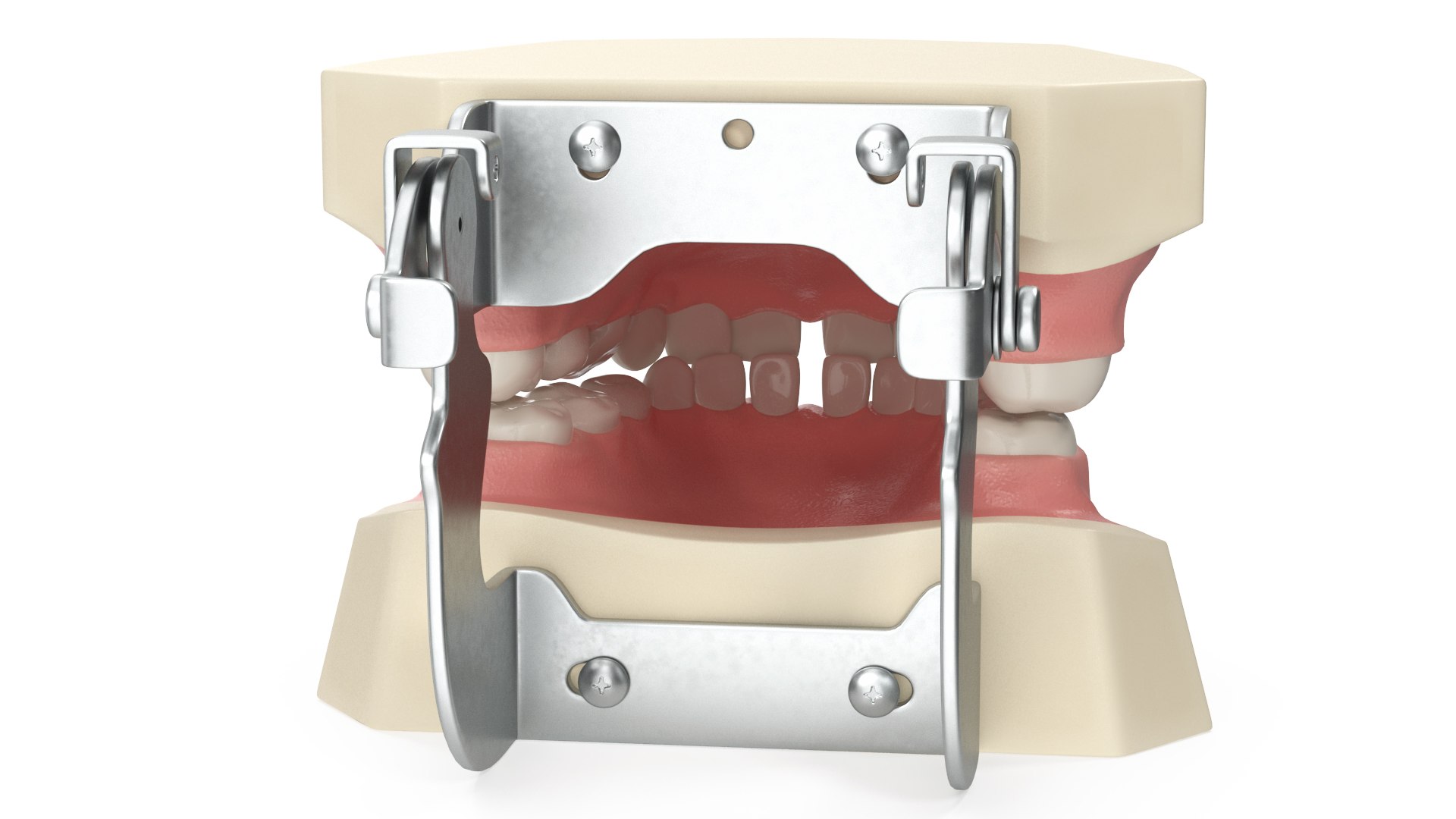 Pediatric Typodont Demonstration Model With Removable Gapped Teeth 3D ...