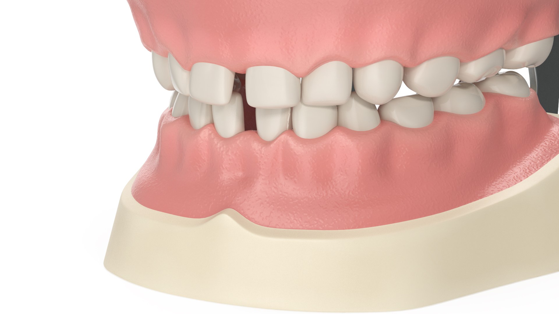 Pediatric Typodont Demonstration Model with Removable Gapped Teeth 3D ...