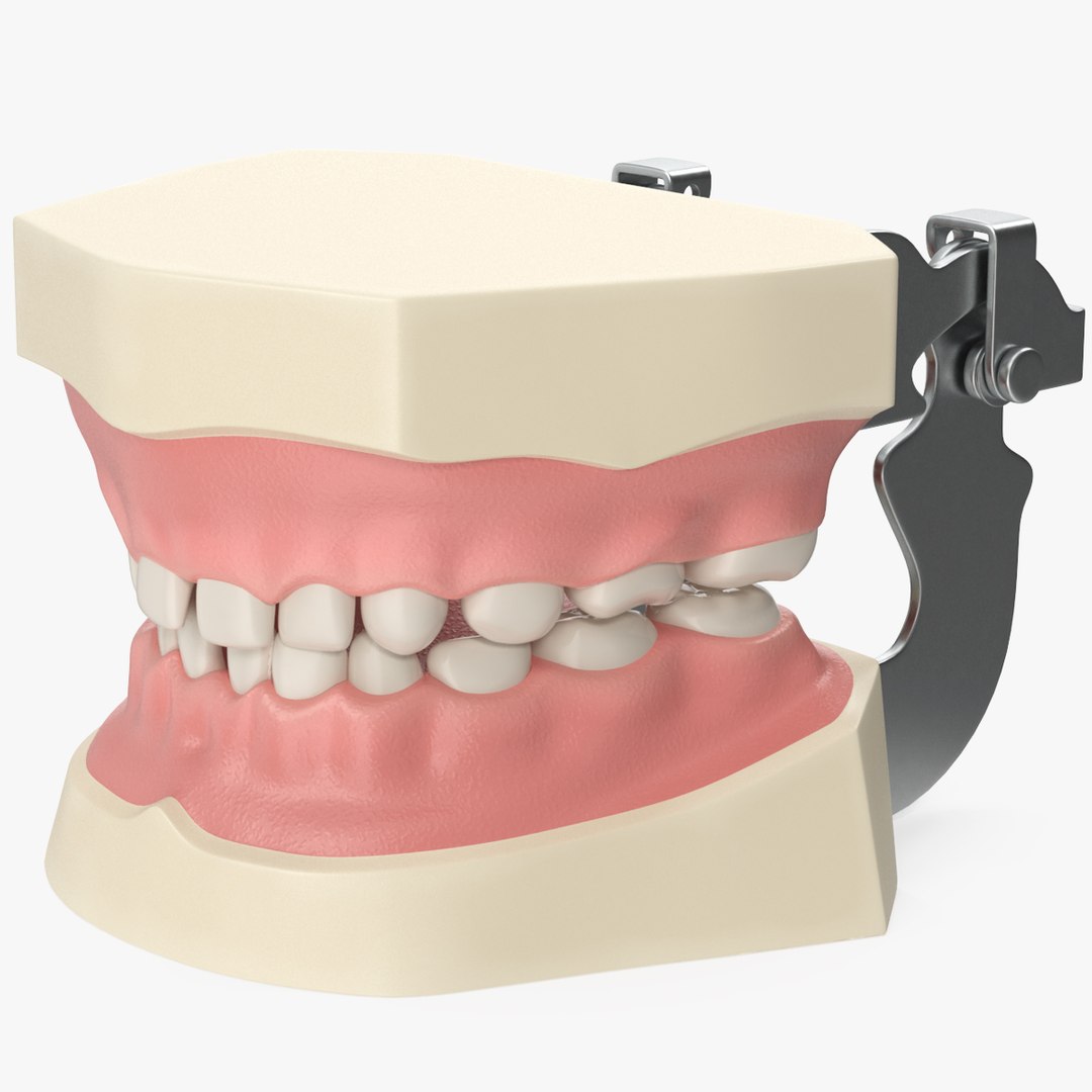 Pediatric Typodont Demonstration Model with Removable Gapped Teeth 3D ...