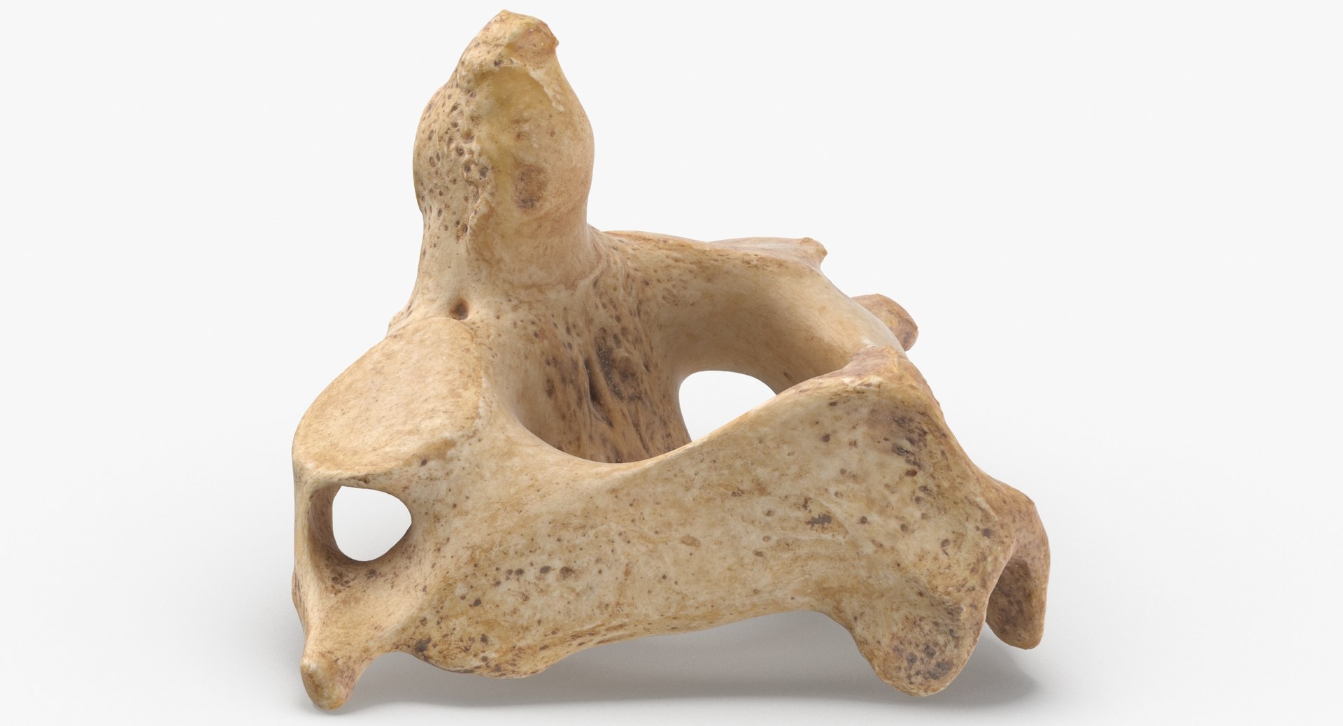 Cervical Vertebrae C2 Axis 3D Model - TurboSquid 1520453