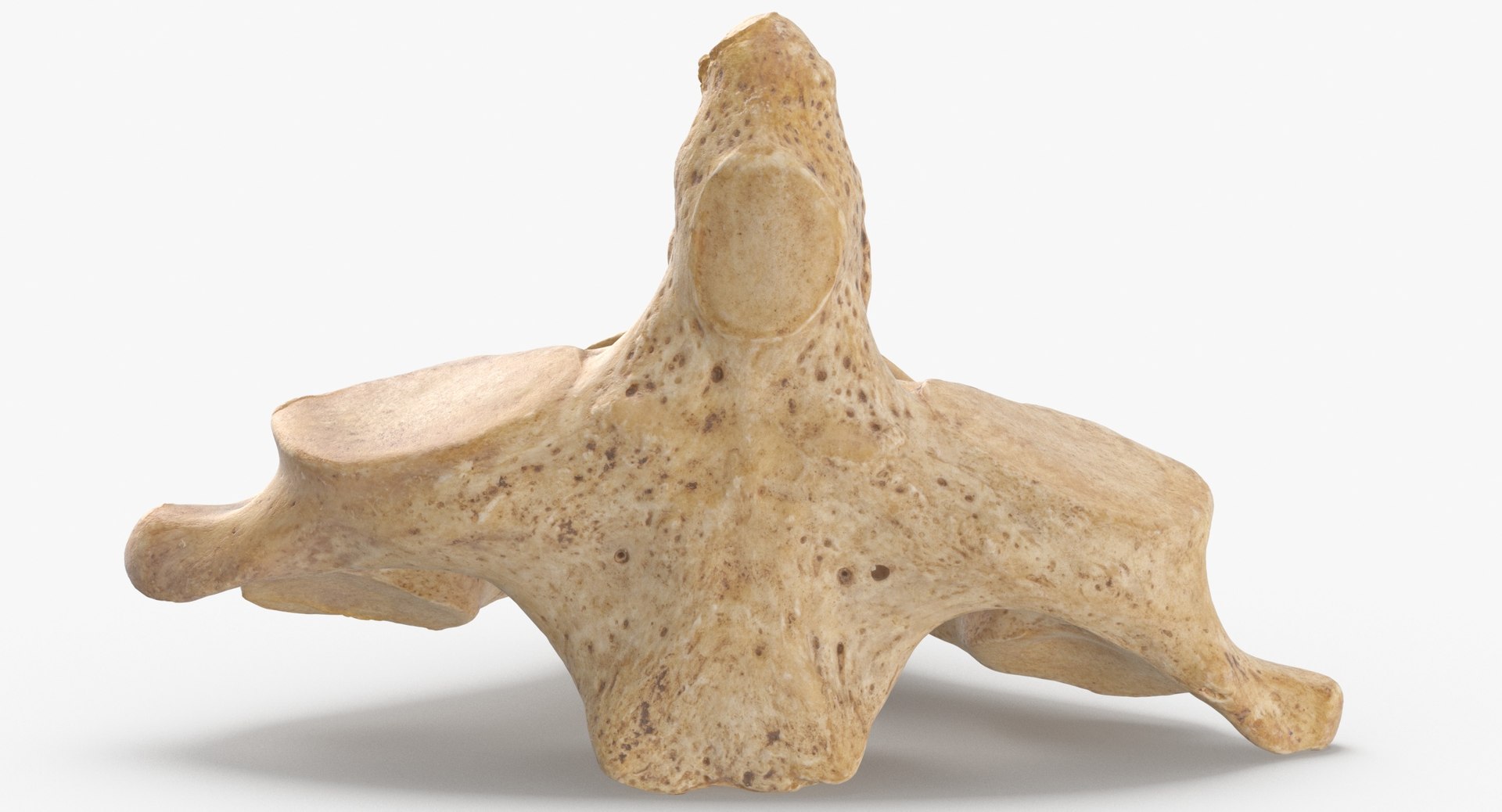 Cervical Vertebrae C2 Axis 3D Model - TurboSquid 1520453