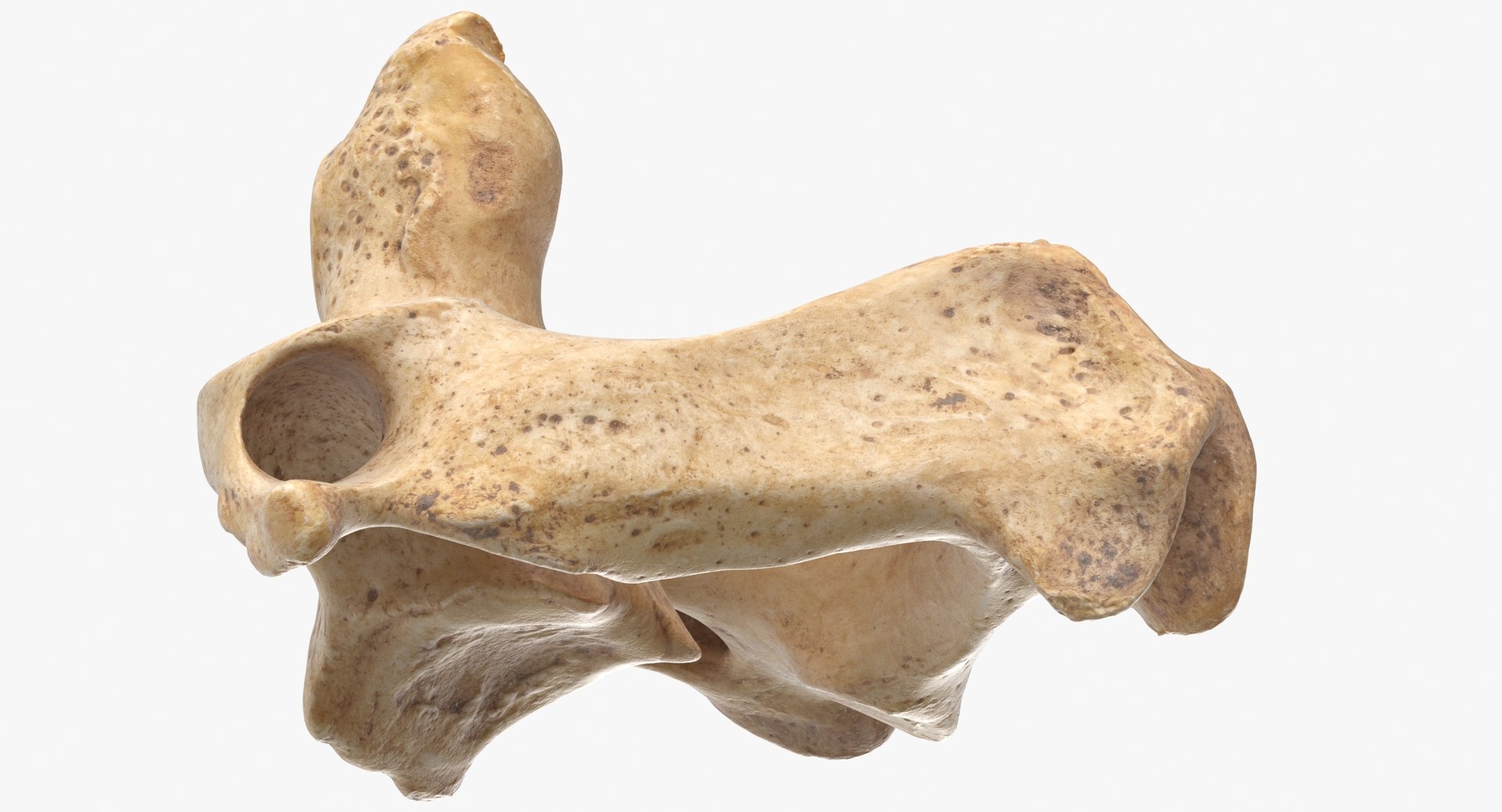 Cervical Vertebrae C2 Axis 3D Model - TurboSquid 1520453