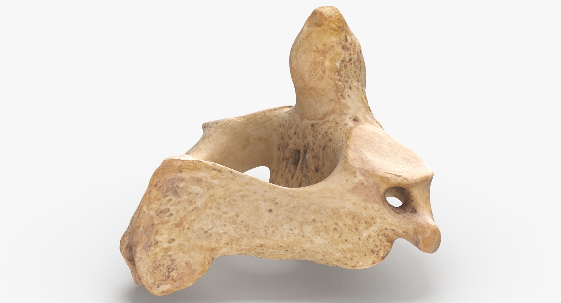Cervical Vertebrae C2 Axis 3D Model - TurboSquid 1520453