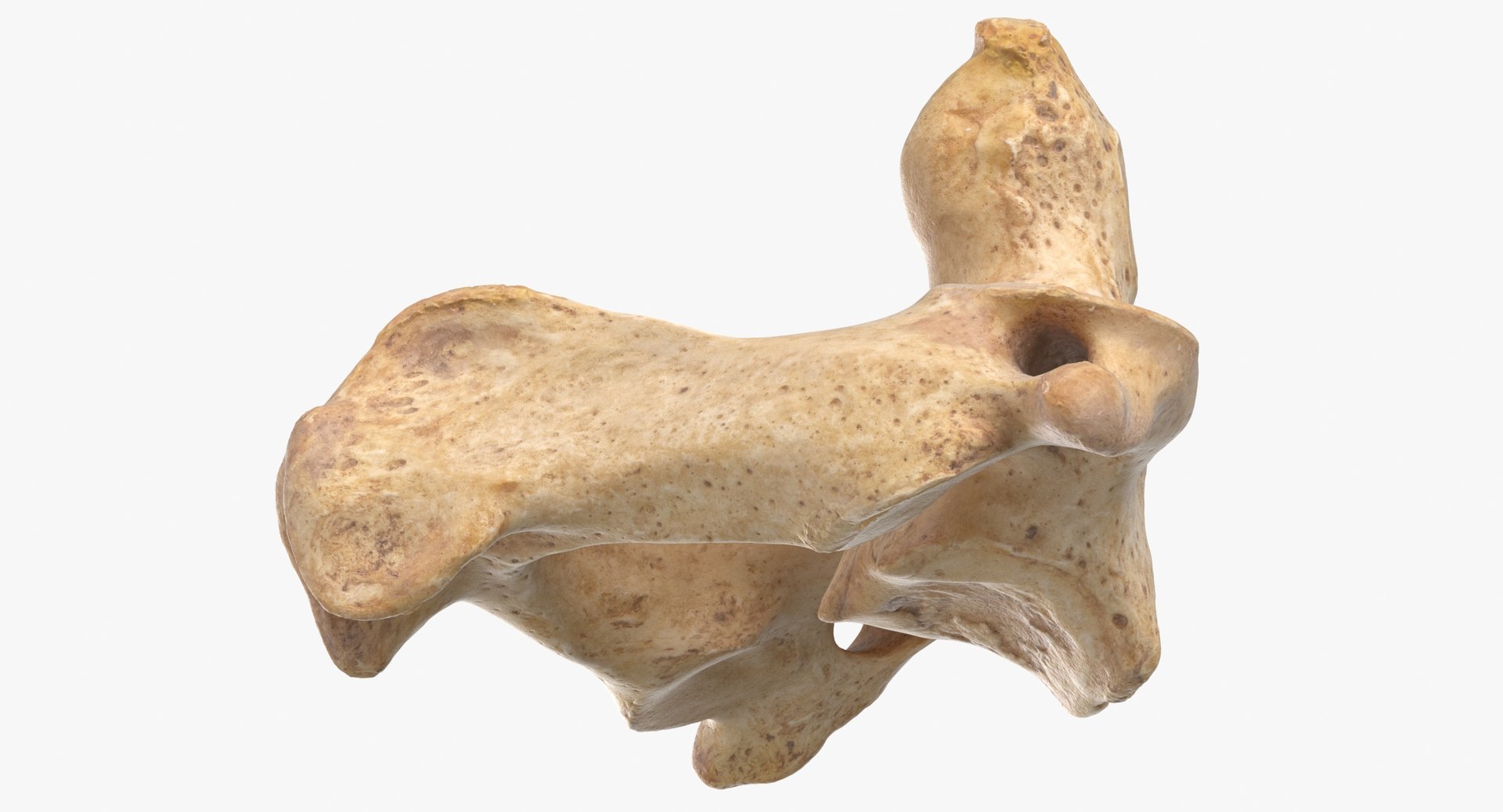 Cervical Vertebrae C2 Axis 3D Model - TurboSquid 1520453