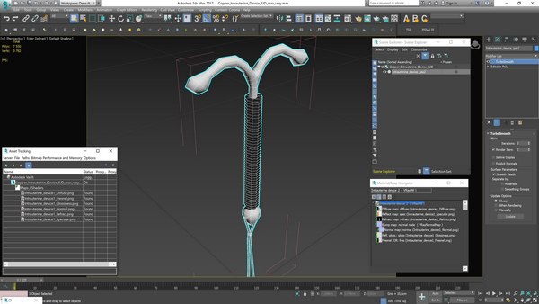 3D Copper Intrauterine Device IUD model - TurboSquid 1926887