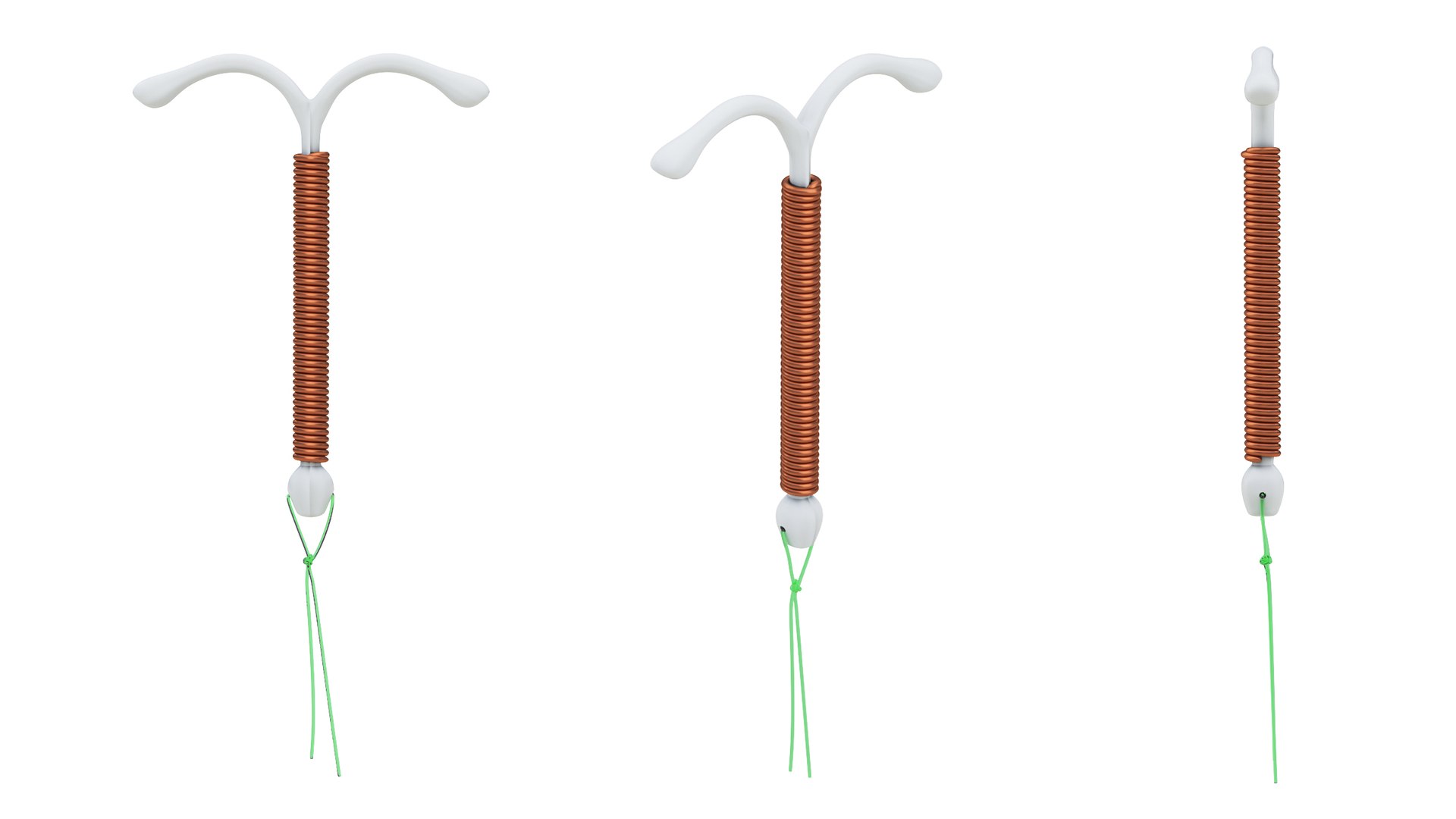 3D Copper Intrauterine Device IUD Model - TurboSquid 1926887