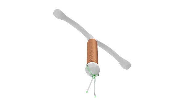 3D Copper Intrauterine Device IUD model - TurboSquid 1926887