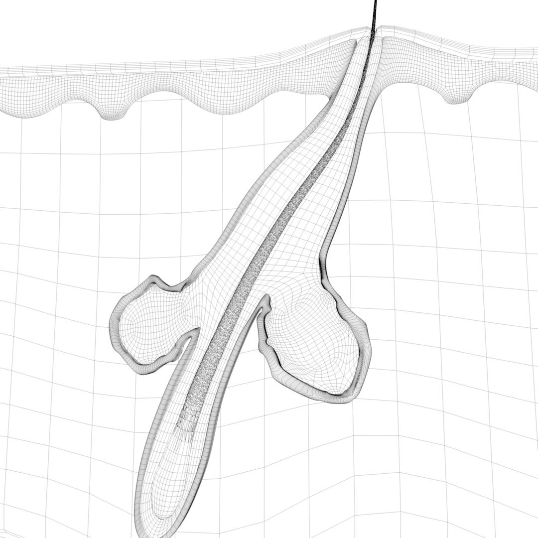 infected acne pore 3d model