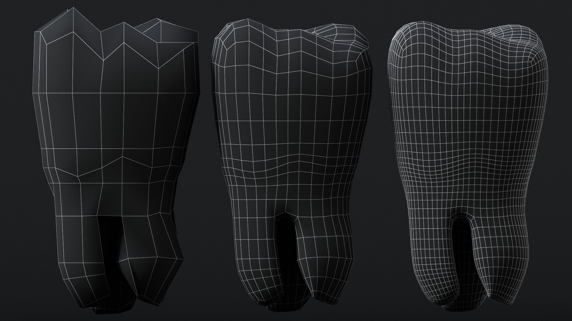 3D Tooth - TurboSquid 1533290