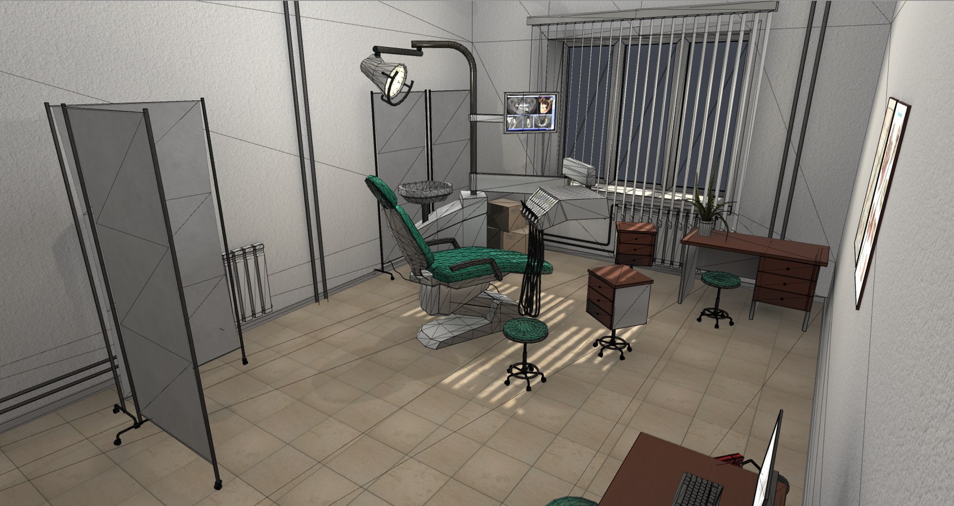 3D dental room - TurboSquid 1416278