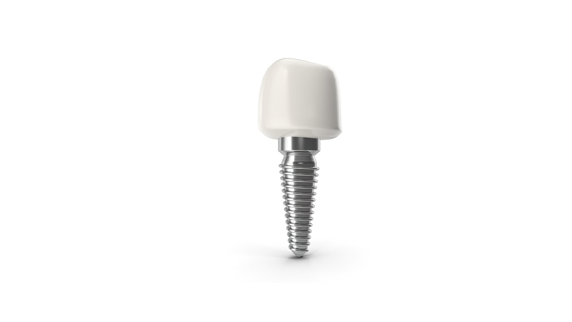 Tooth Implant 3D Model - TurboSquid 2126551