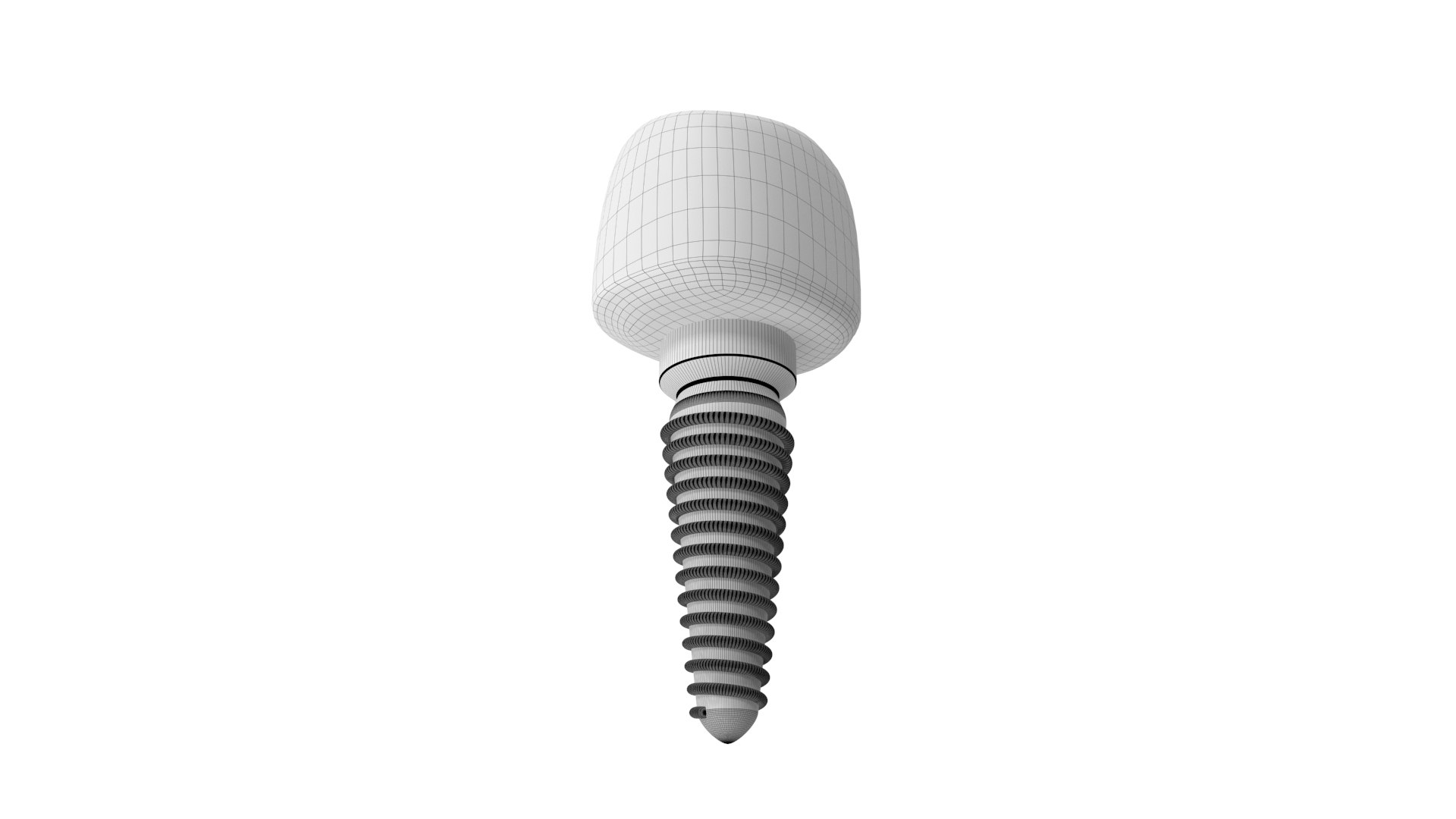 Tooth Implant 3D Model - TurboSquid 2126551